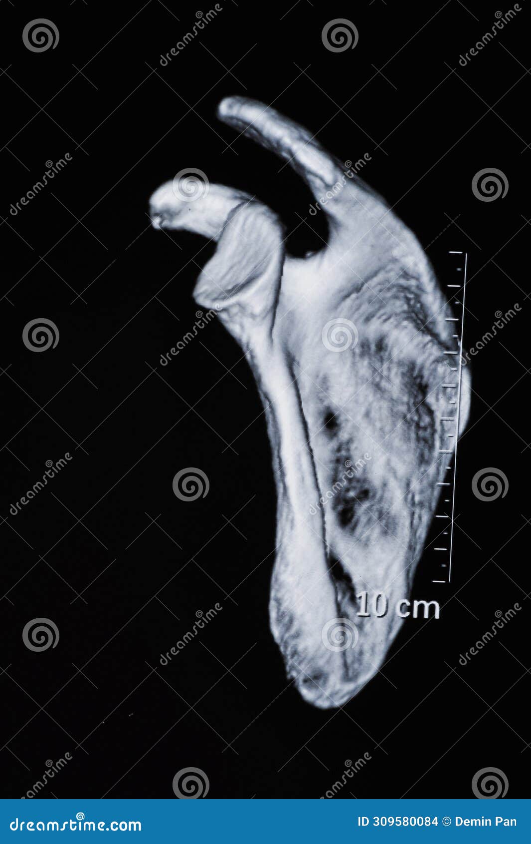 Human bone CT images stock photo. Image of bone, pain - 309580084