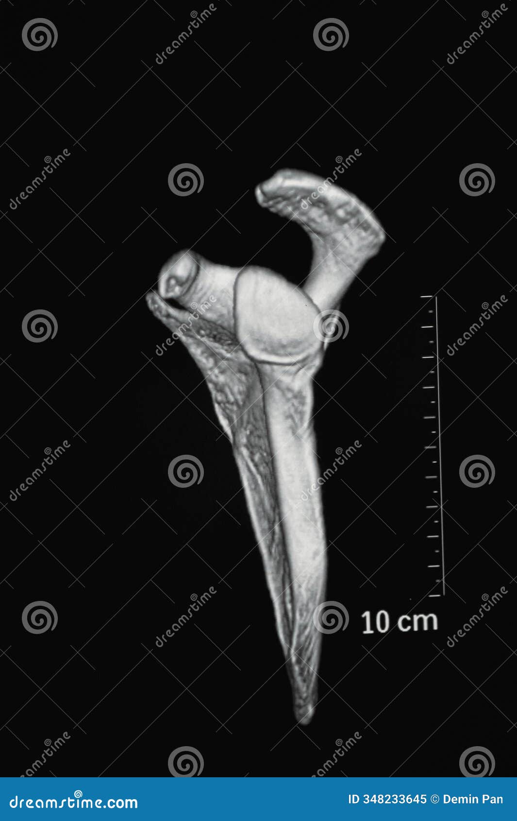 Human bone CT images stock illustration. Illustration of human - 348233645