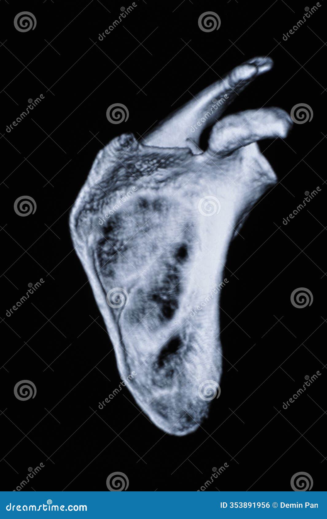 Human bone CT images stock illustration. Illustration of cord - 353891956