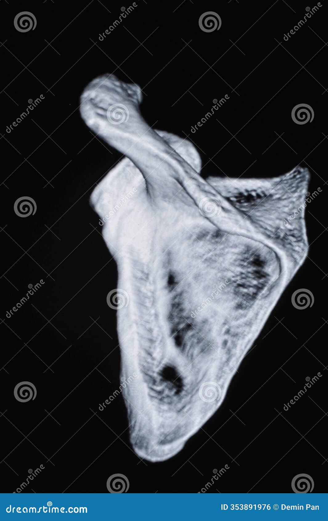 Human bone CT images stock illustration. Illustration of hospital ...