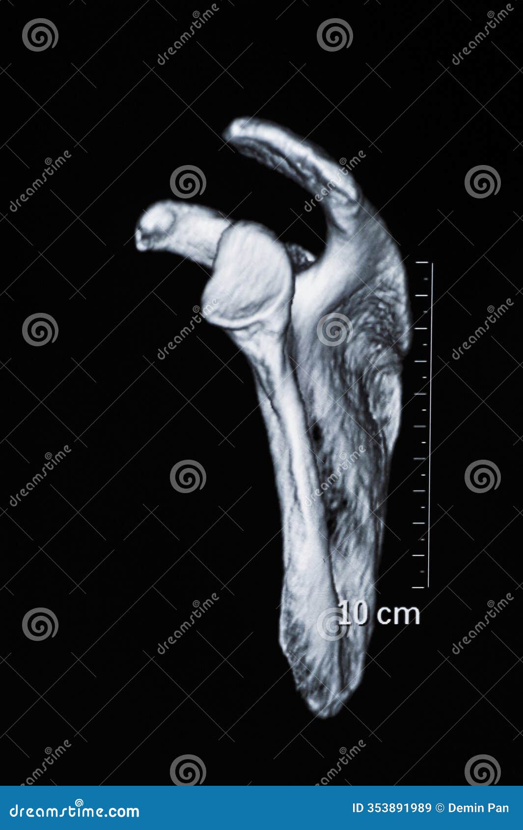 Human bone CT images stock illustration. Illustration of spinal - 353891989