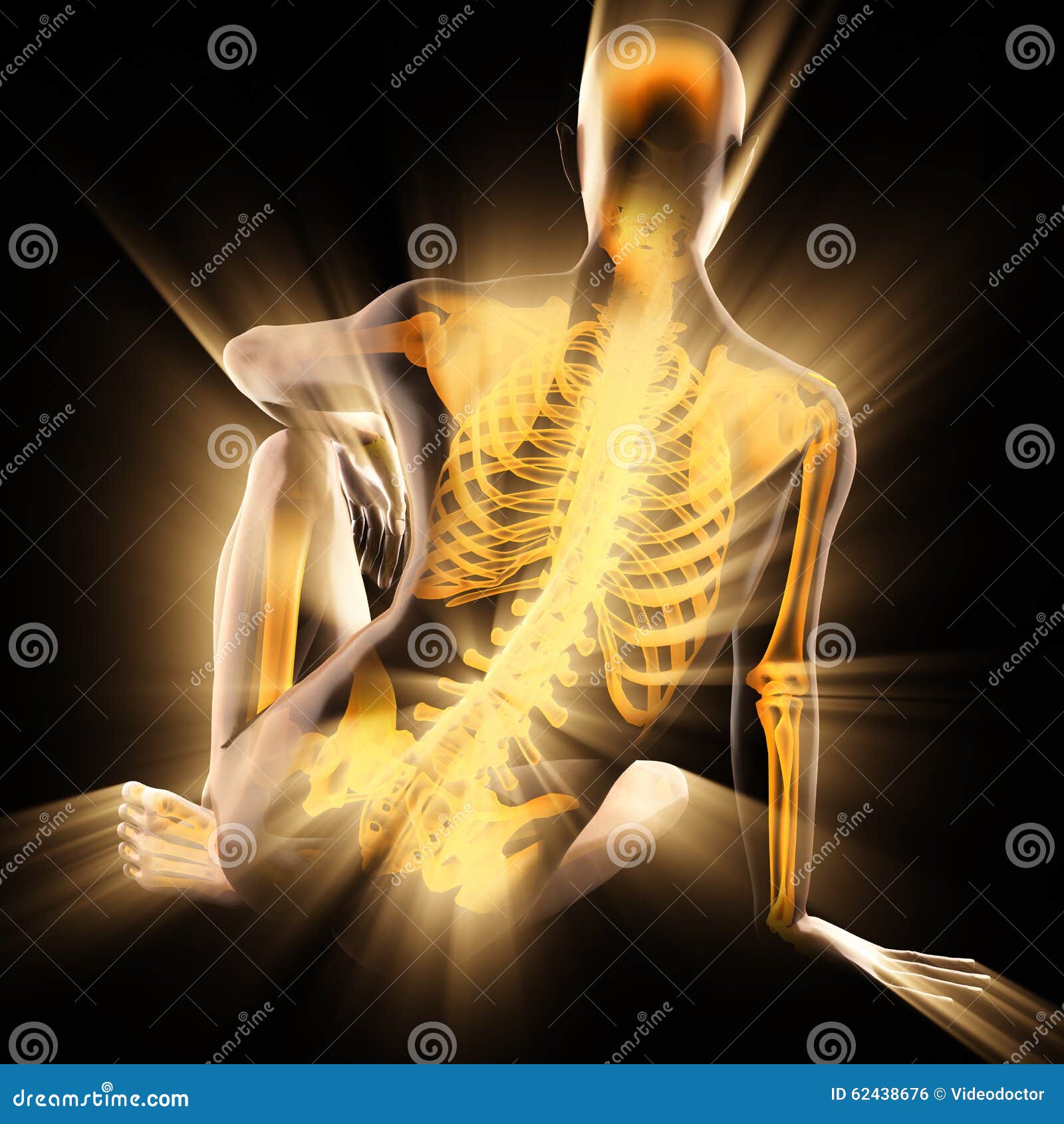 Human Bones Radiography Scan Image Stock Photo - Image of healthcare ...