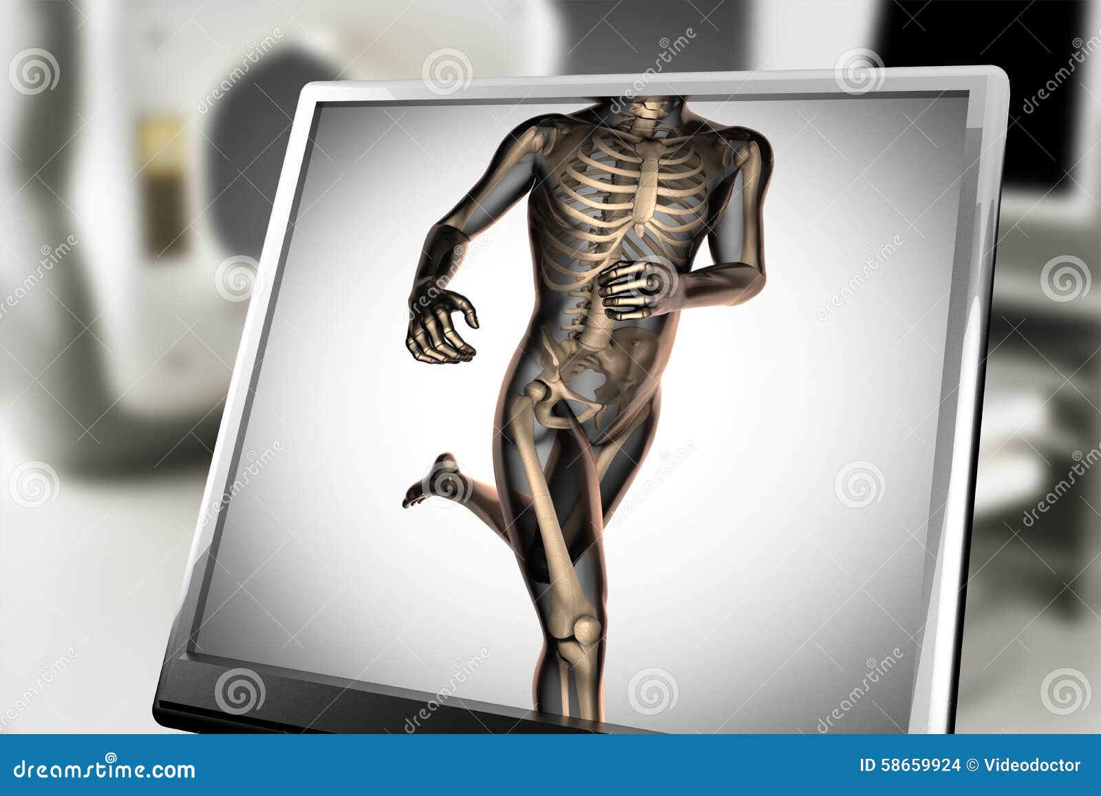 Human Bones Radiography Scan Image Stock Illustration - Illustration of ...