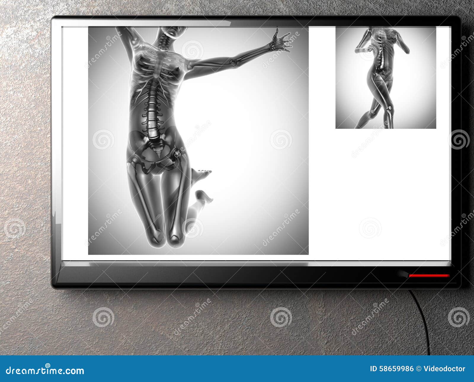 Human Bones Radiography Scan Image Stock Photo - Image of backbone ...