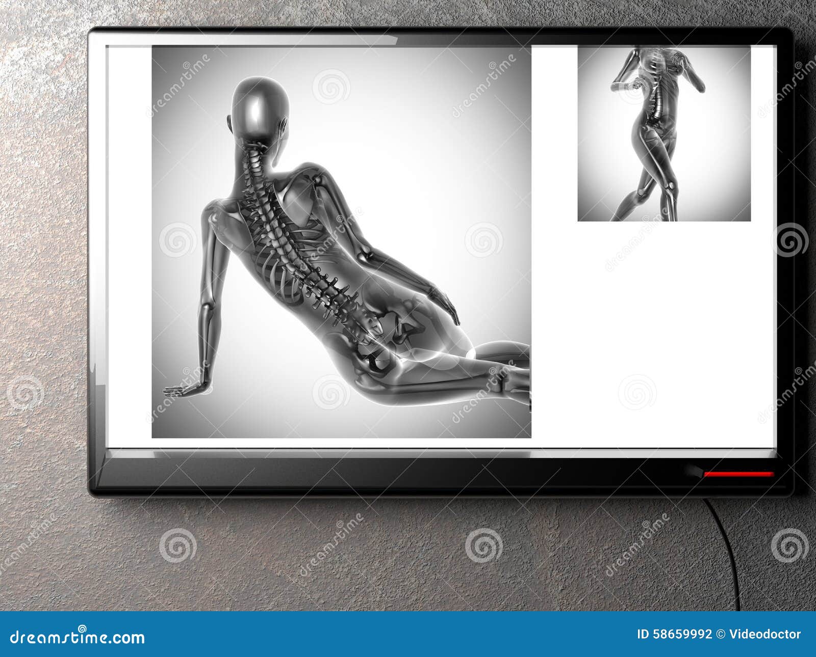 Human Bones Radiography Scan Image Stock Illustration - Illustration of ...