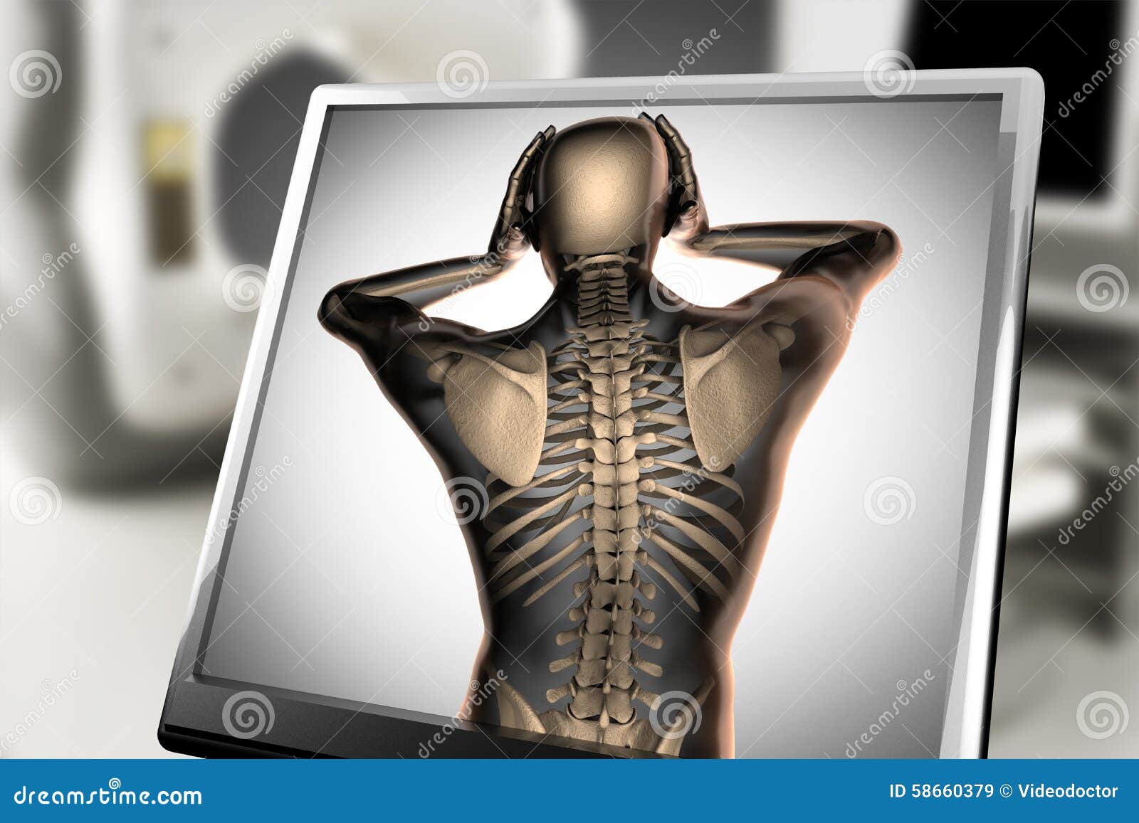 Human Bones Radiography Scan Image Stock Image - Image of adult ...