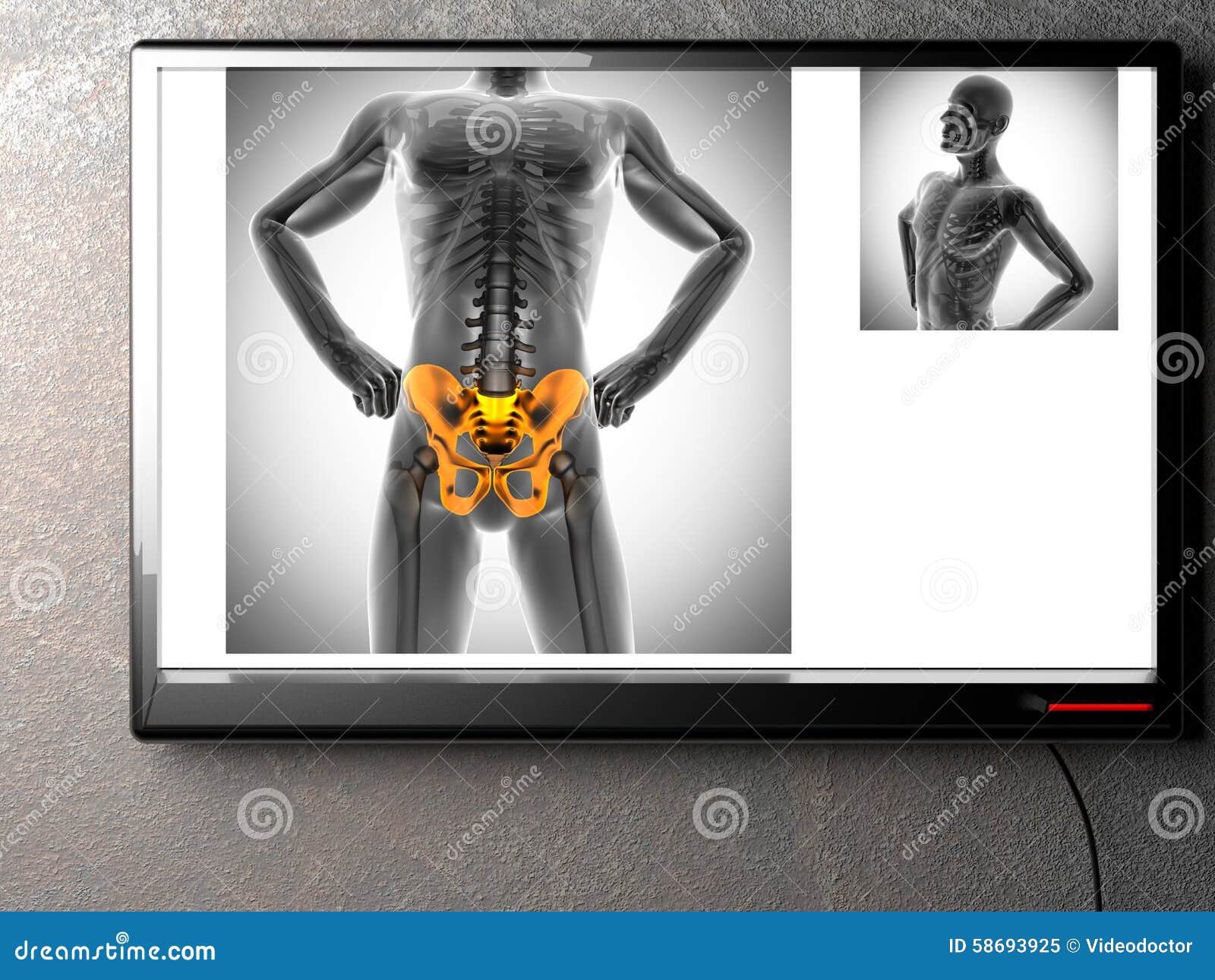 Human Bones Radiography Scan Image Stock Image - Image of medical ...