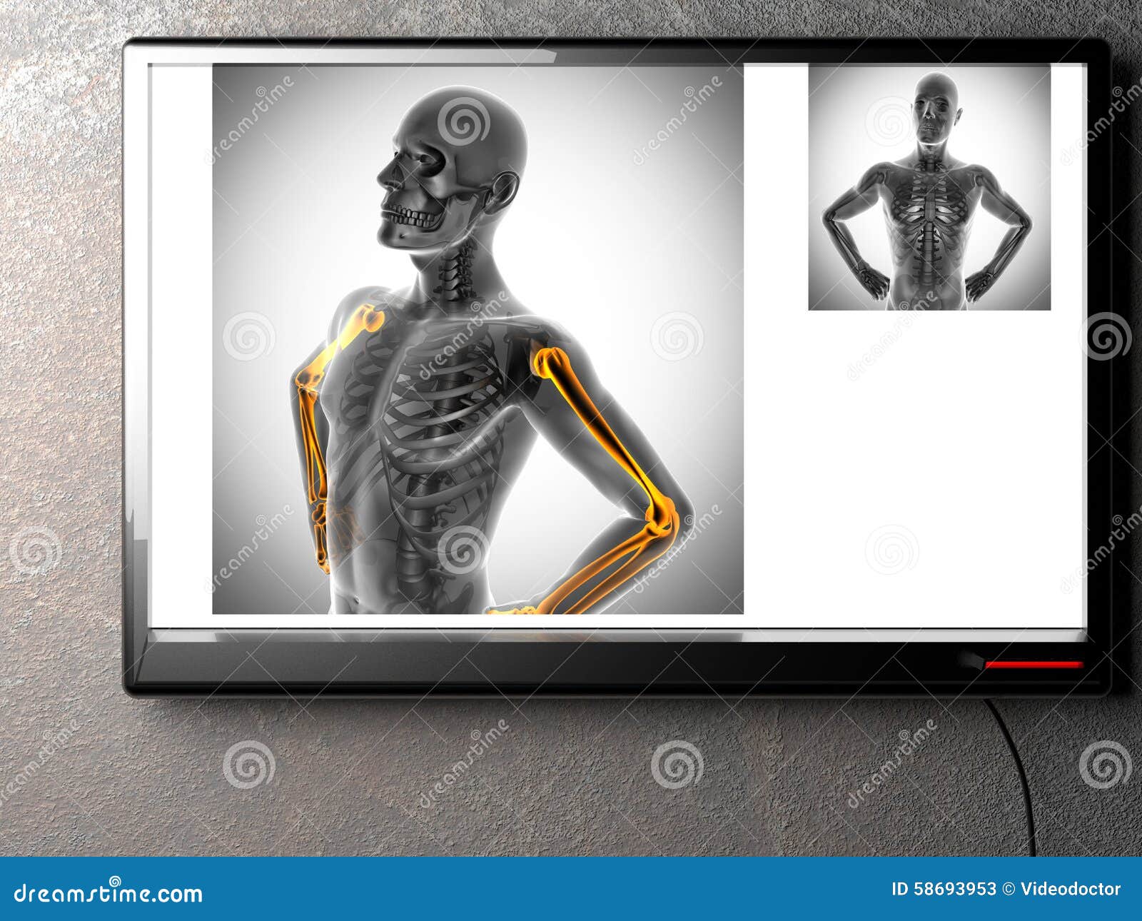 Human Bones Radiography Scan Image Stock Image - Image of radiography ...