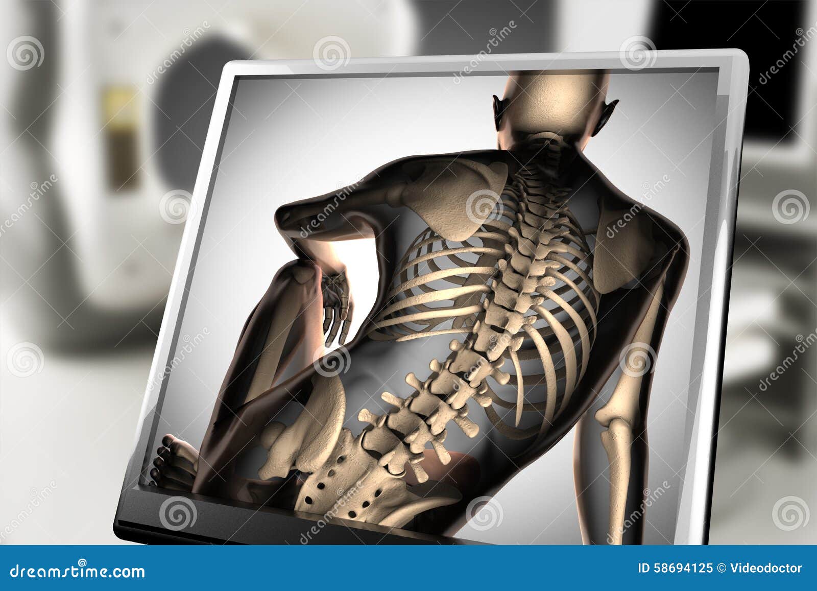 Human Bones Radiography Scan Image Stock Image - Image of injury ...