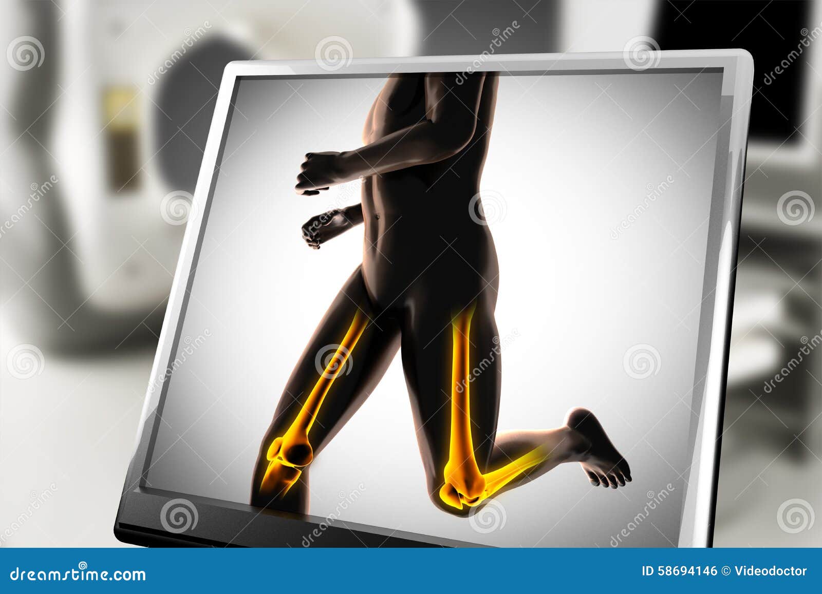 Human Bones Radiography Scan Image Stock Photo - Image of radiography ...