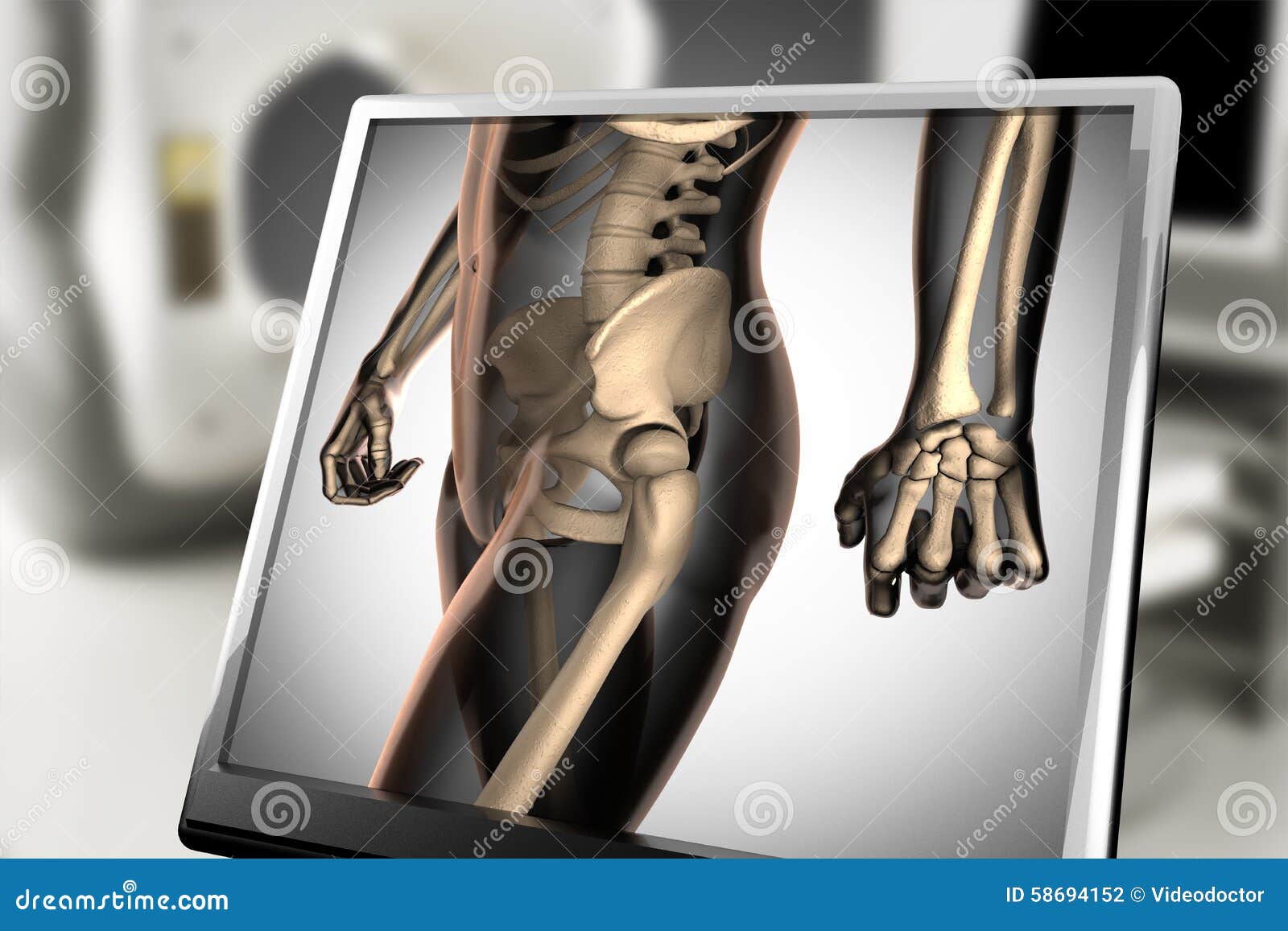 Human Bones Radiography Scan Image Stock Photo - Image of attend ...