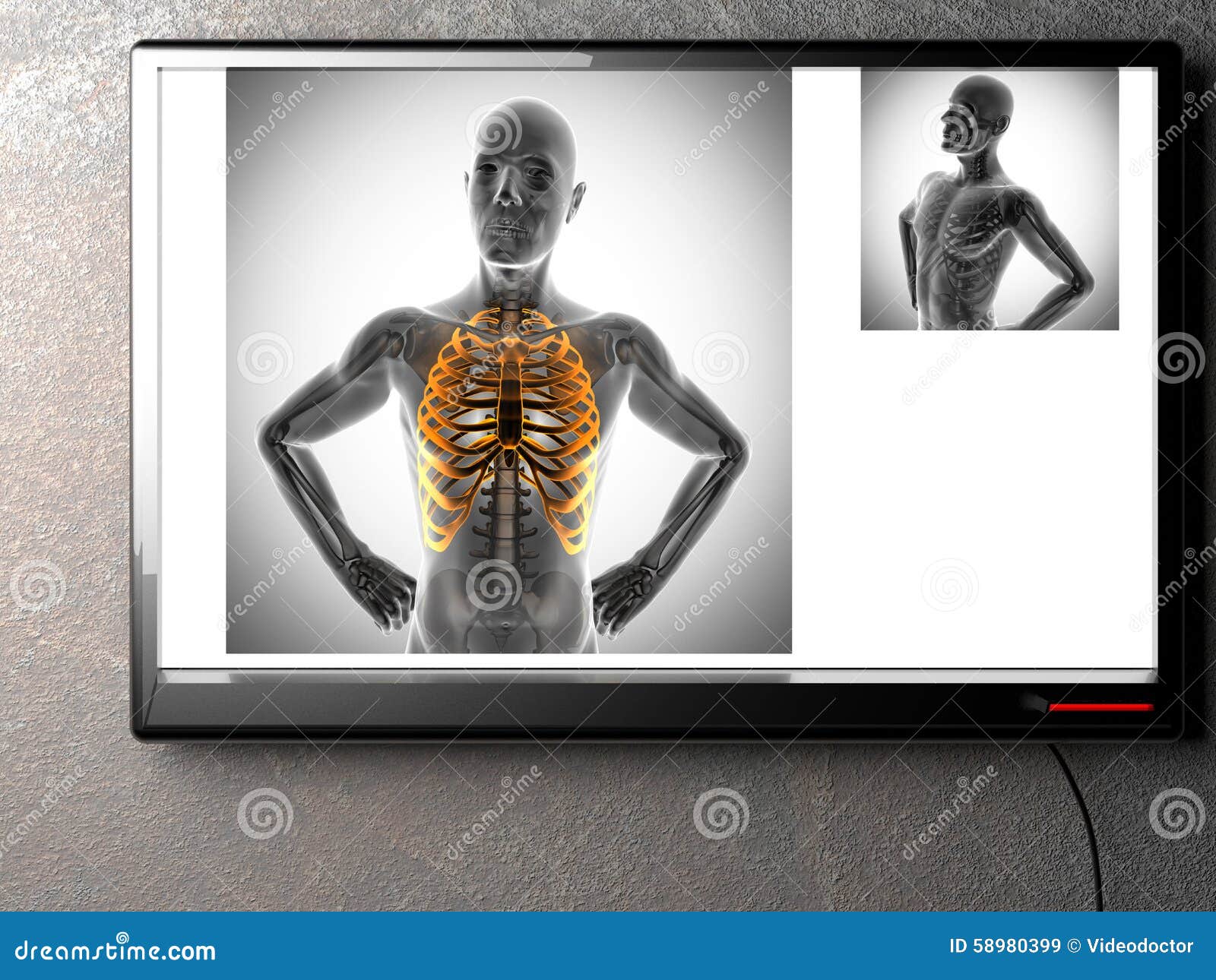 Human Bones Radiography Scan Image Stock Image - Image of patient ...