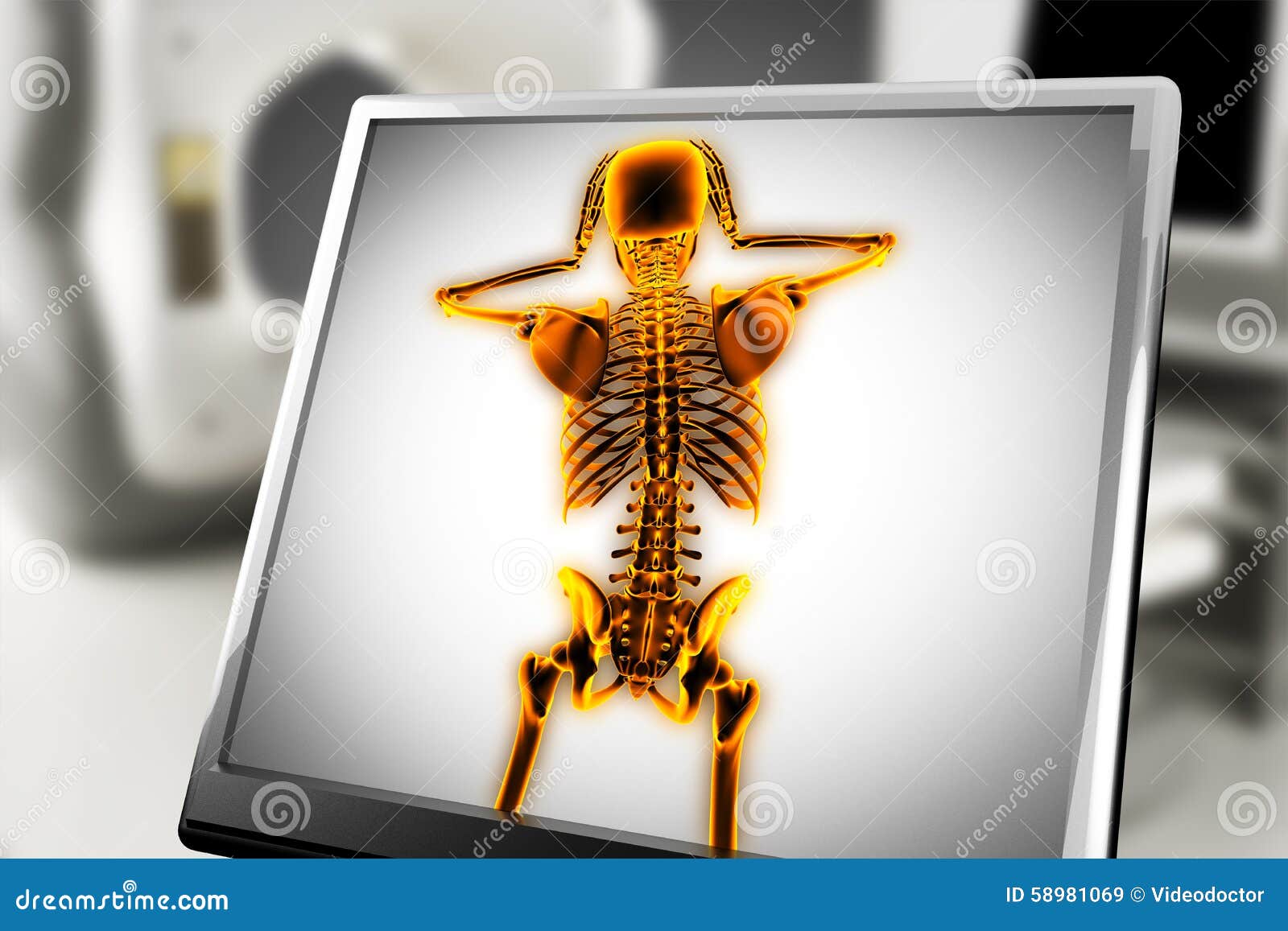 Human Bones Radiography Scan Image Stock Image - Image of hospital ...