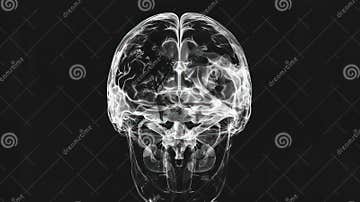Human Brain in a Ct Scan Created with Generative AI. Scanning with X ...