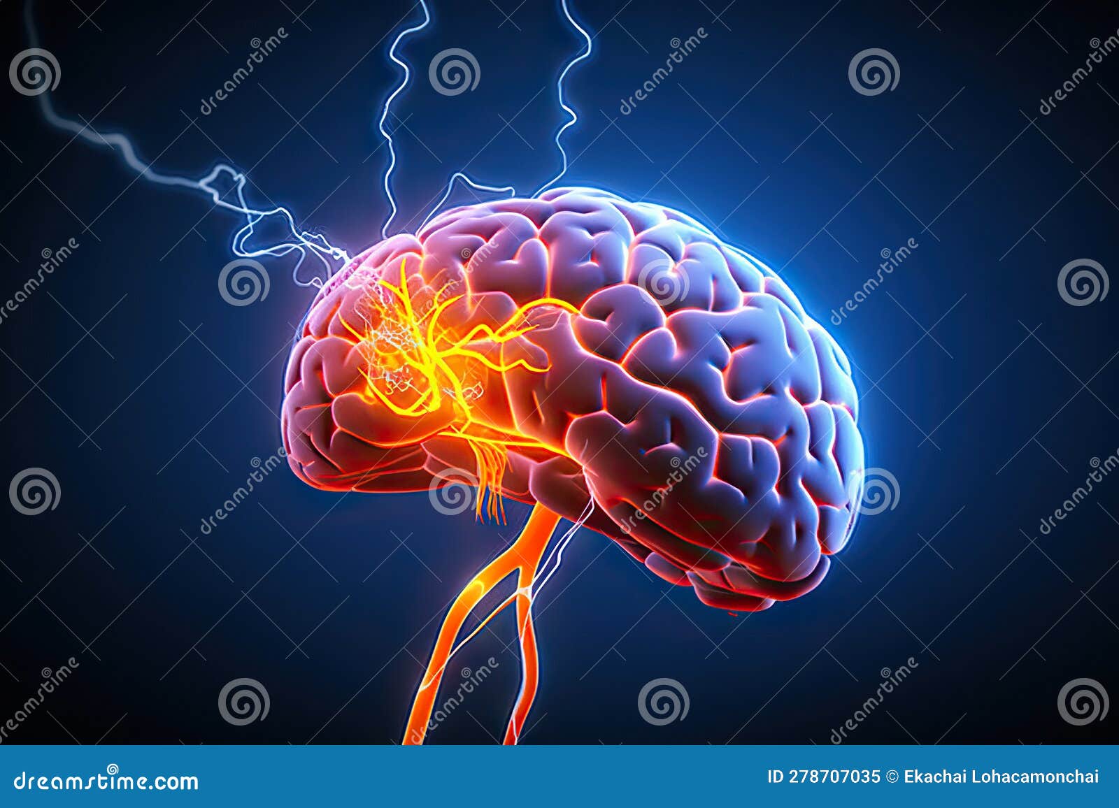 Human Brain with Electric Connections, Embodiment of Smart Ideas ...