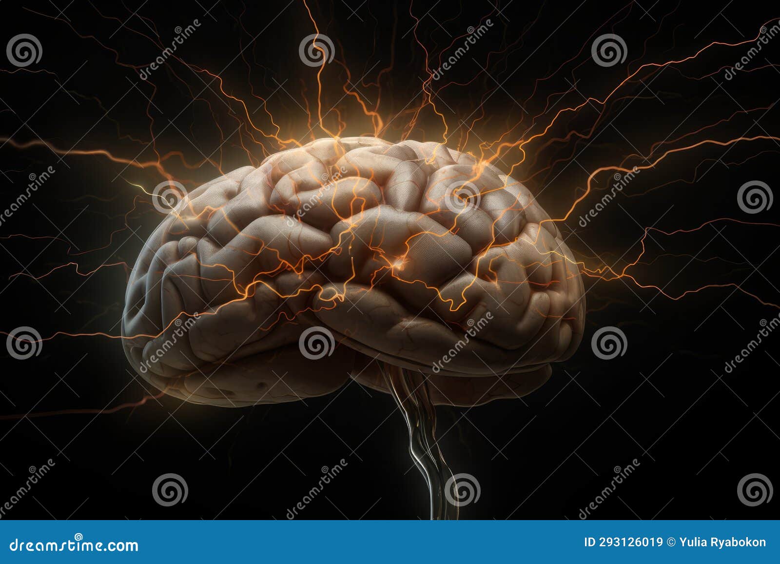 Electric Shock In My Brain at John Moses blog