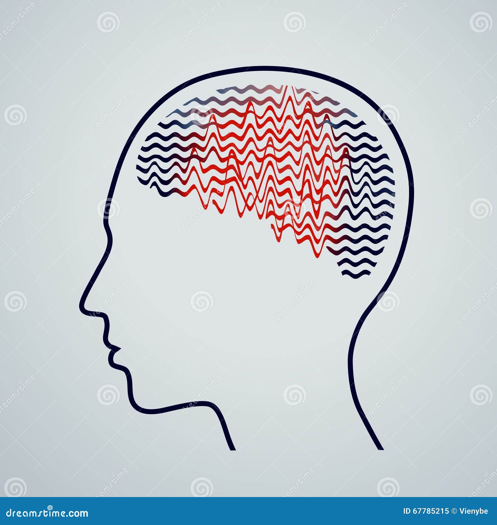 Human Brain with Epilepsy Activity, Vector Illustration Stock Vector ... Human Brain with Epilepsy Activity, Vector Illustration Stock Vector ...