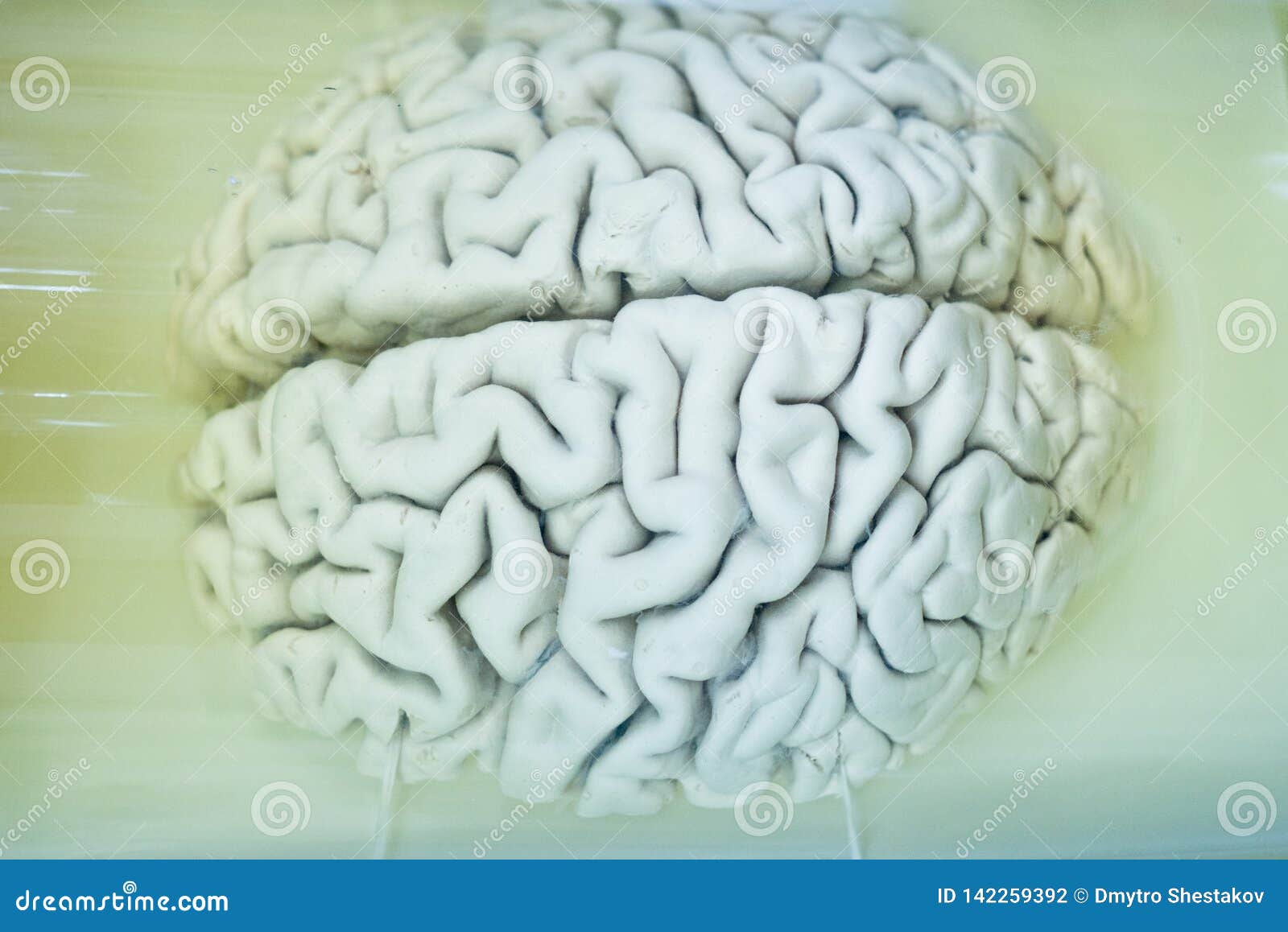 Human Brain in Formalin Solution Closeup Stock Photo - Image of glass ...