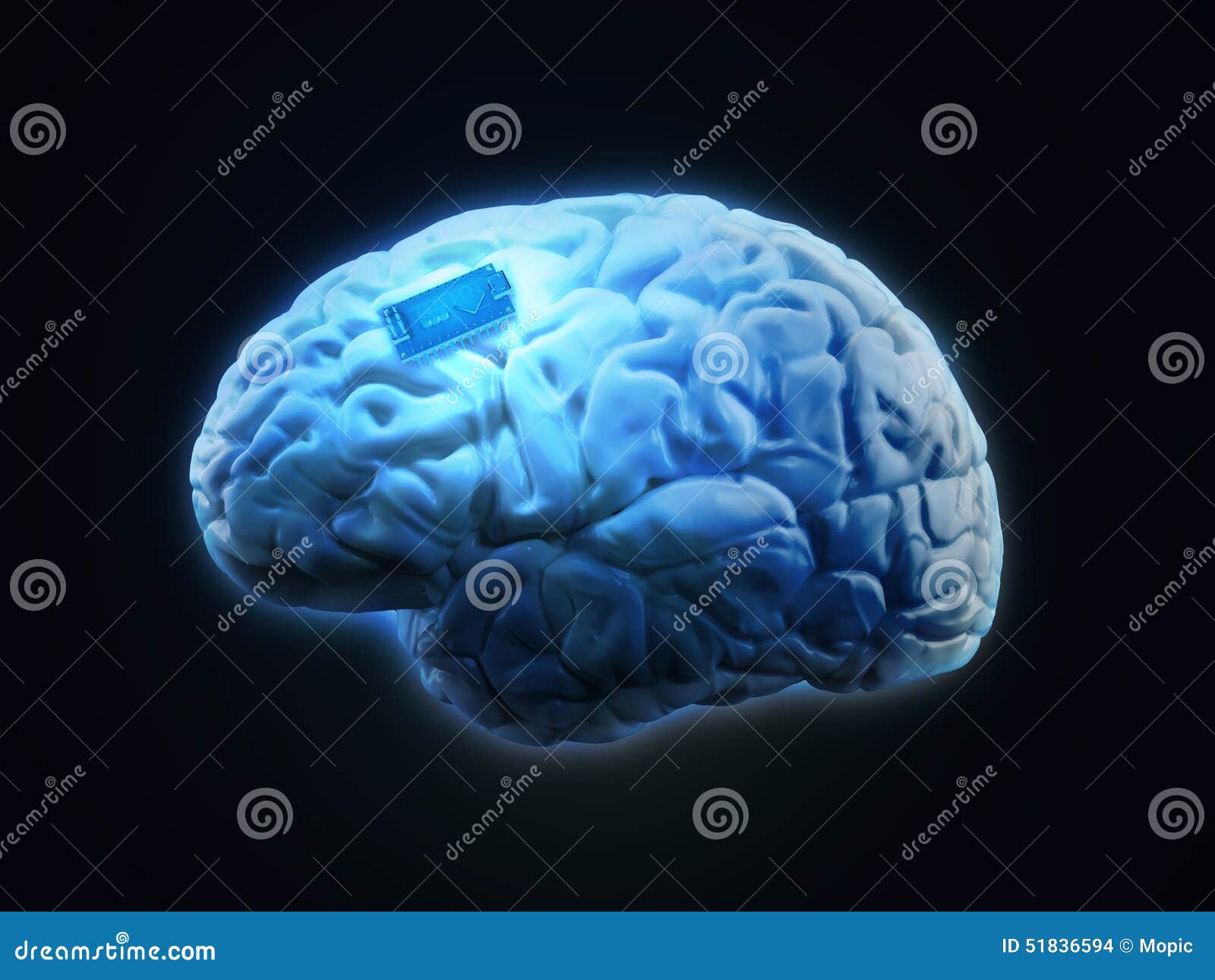 Human brain implant stock illustration. Illustration of medicine - 51836594