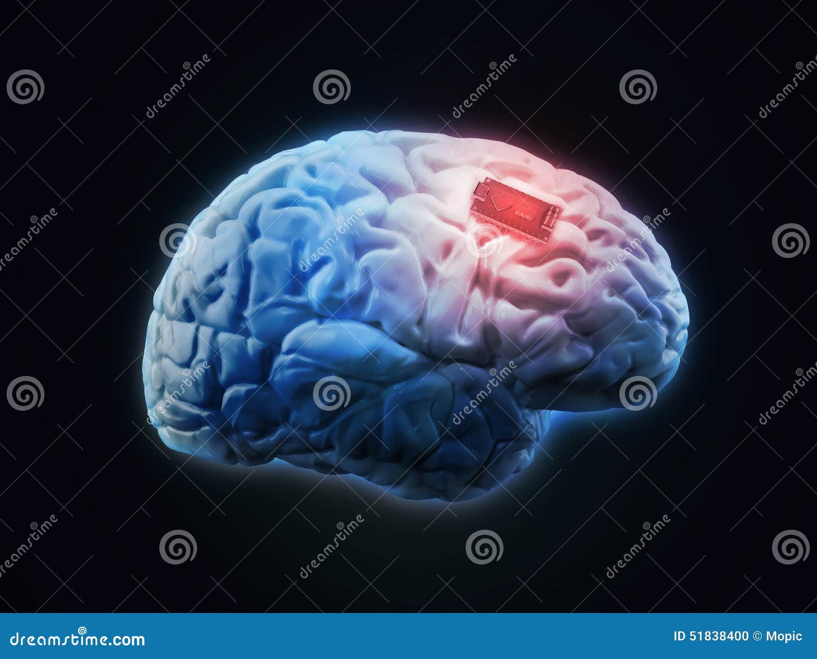 Human brain implant stock illustration. Illustration of cyberspace ...