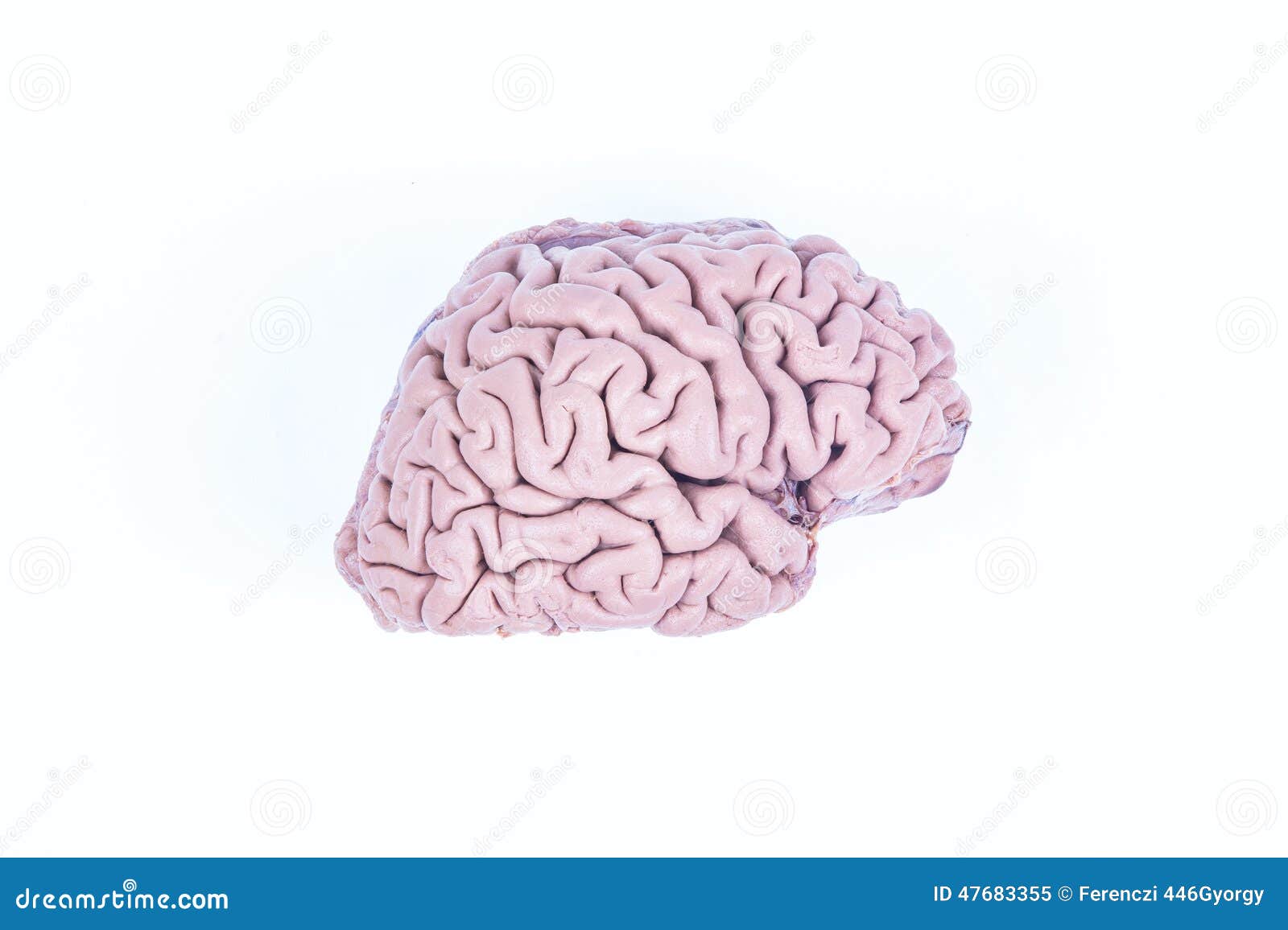 Lobotomy Of A Brain, Red Fake Human Brain. Royalty-Free Stock Photo ...