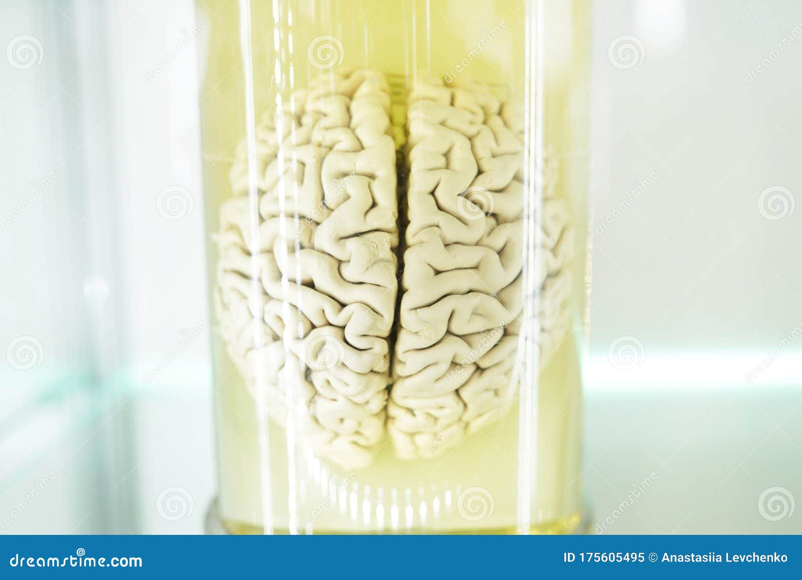 Human Brain in a Jar Real Specimen Stock Image - Image of scientific ...