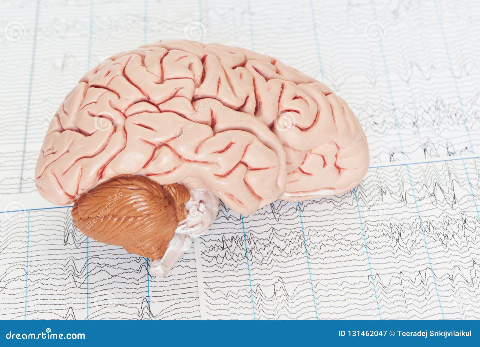 Human Brain Model on Background of Brain Waves Stock Image - Image of ...