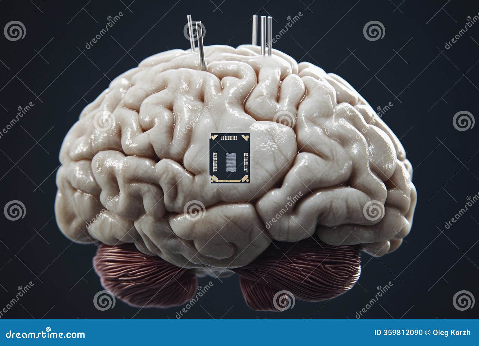 Human Brain Model with Electronic Chip Representation Highlighting Technology and Biology ...