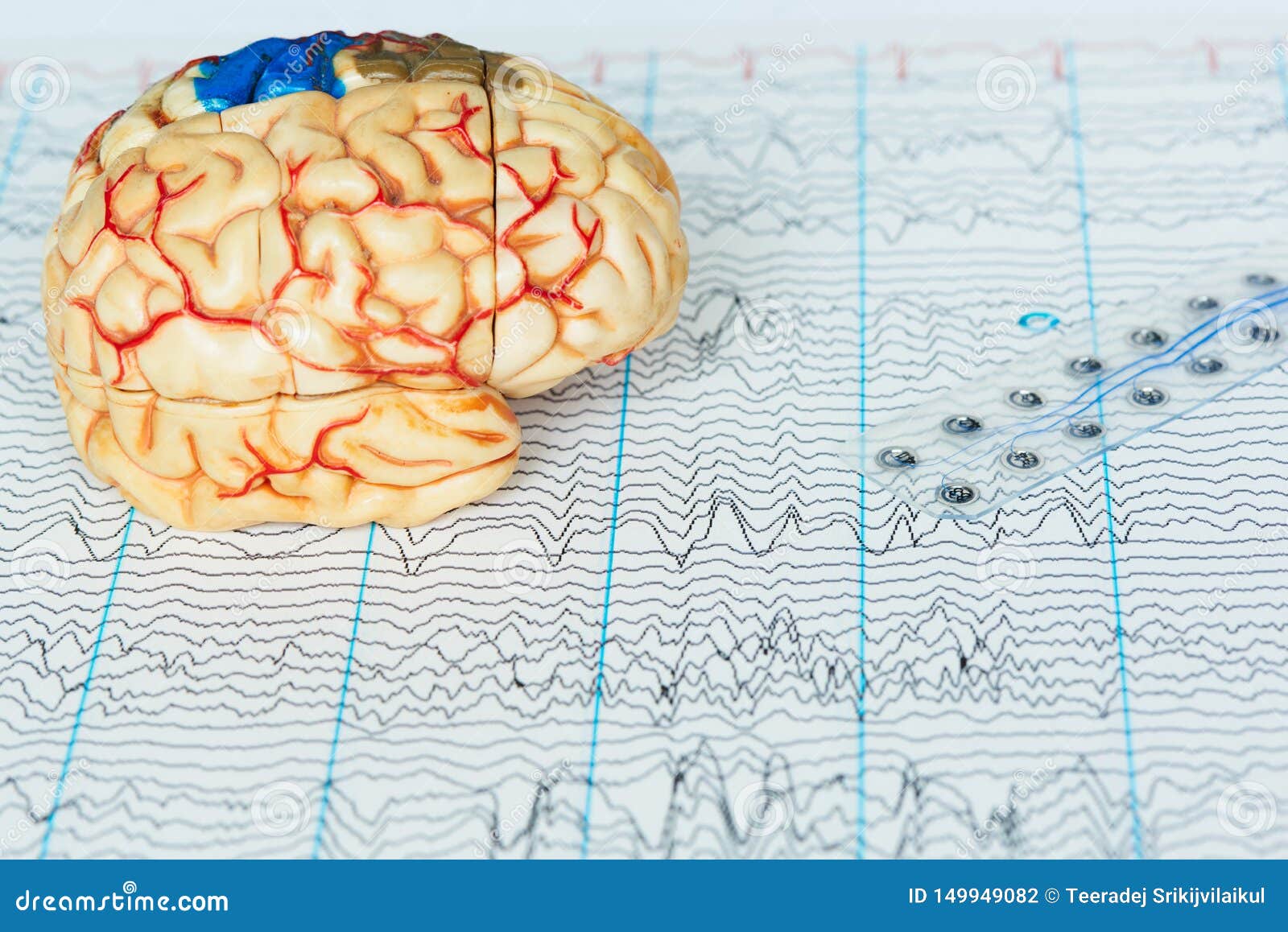 Electrode Recording Brain Waves On EEG Paper Stock Photography ...