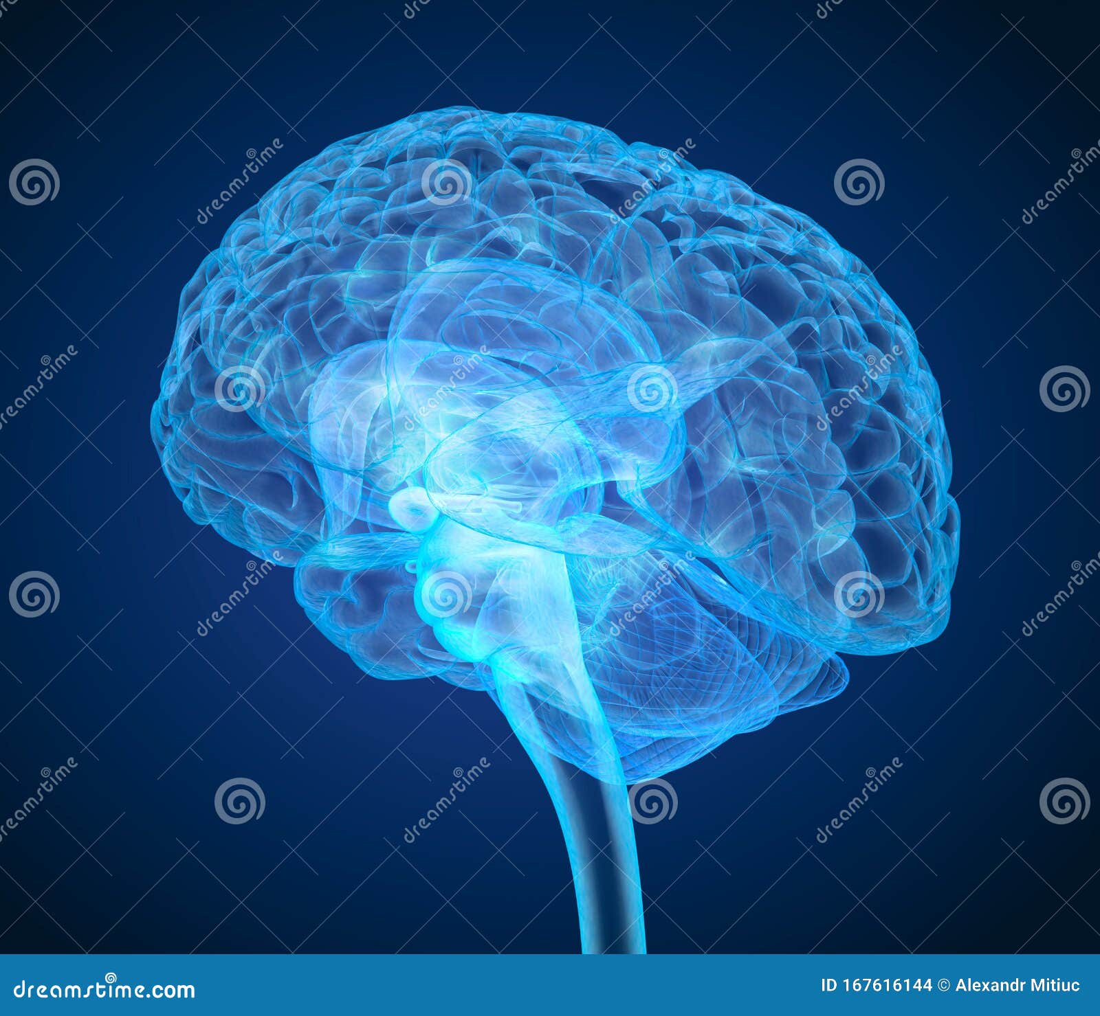Human Brain X-ray Scan , Medically Accurate Stock Illustration ...