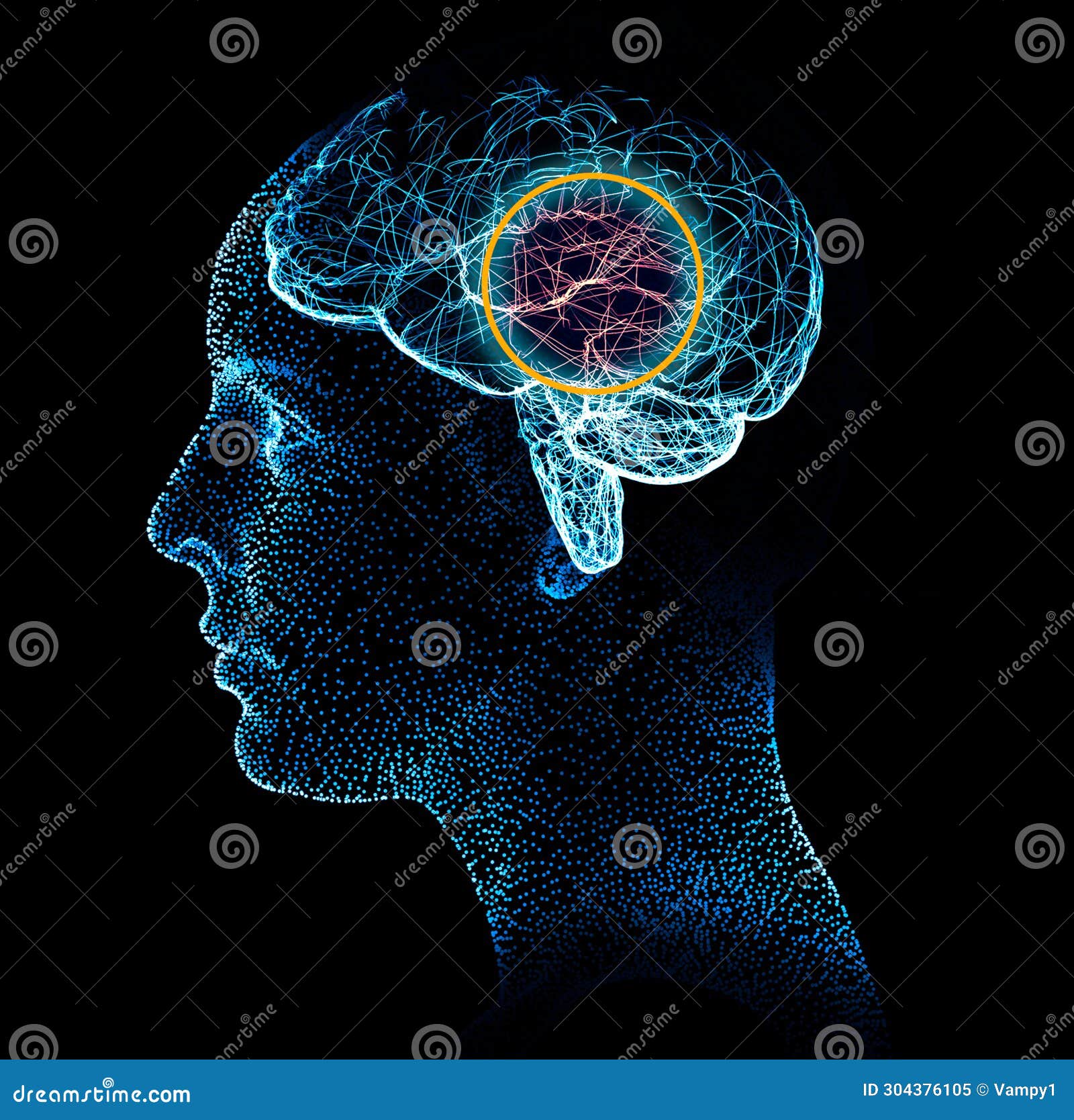 Human Brain Side View. X-rays. Degenerative Disease, Synapses and ...