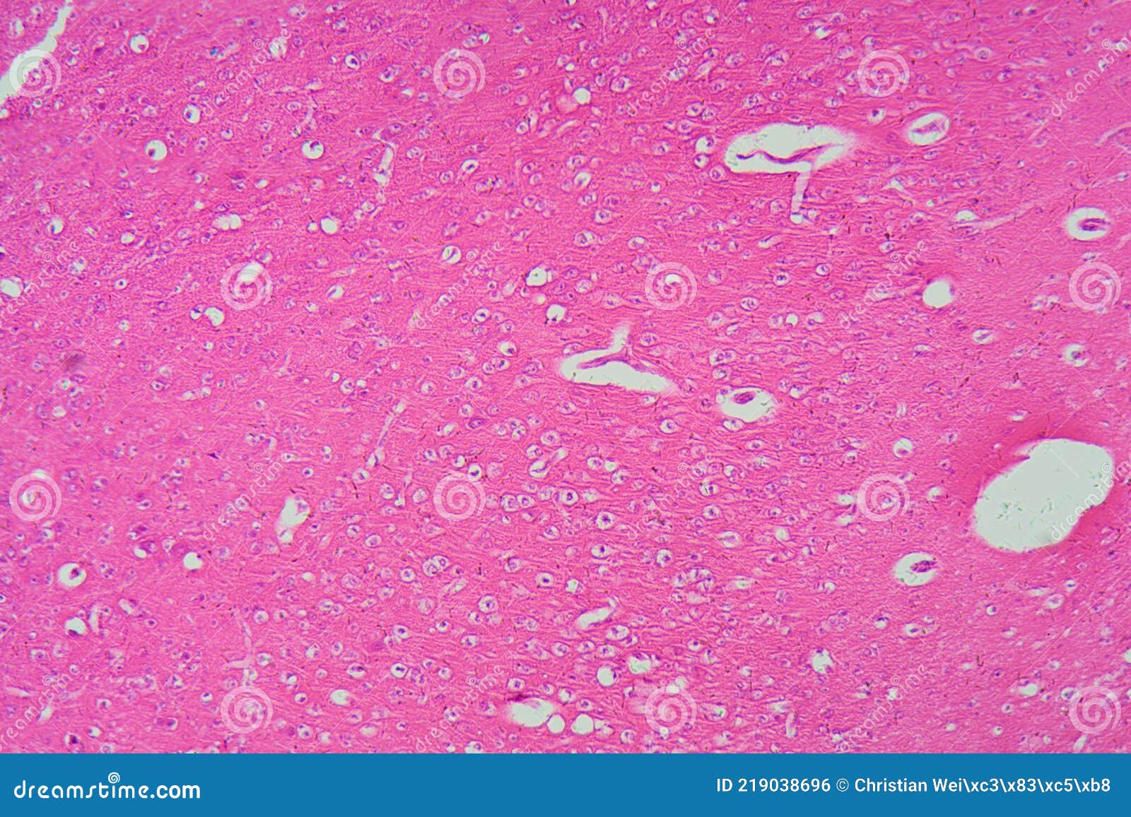 Human Brain Under the Microscope Stock Photo - Image of macro ...