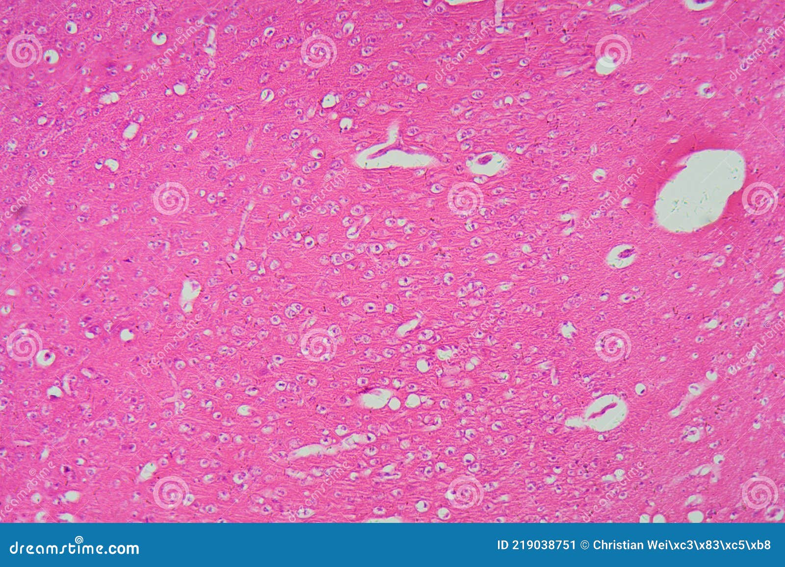 Human Brain Under the Microscope Stock Image - Image of closeup ...