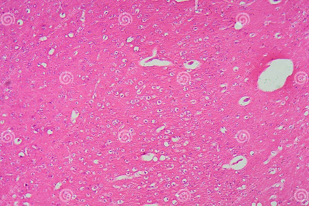 Human Brain Under the Microscope Stock Image - Image of closeup ...