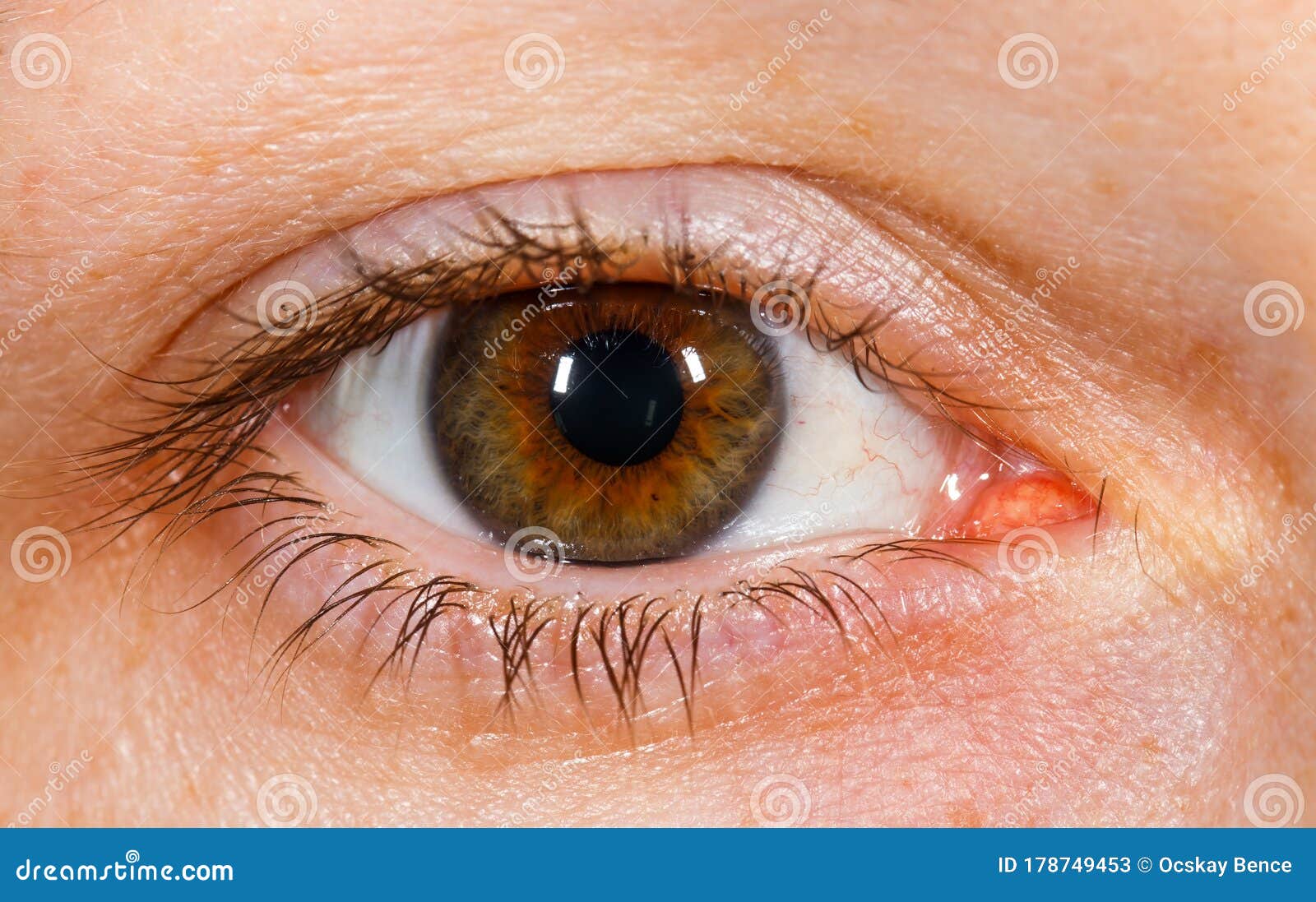 Human brown eye stock image. Image of medical, looking - 178749453