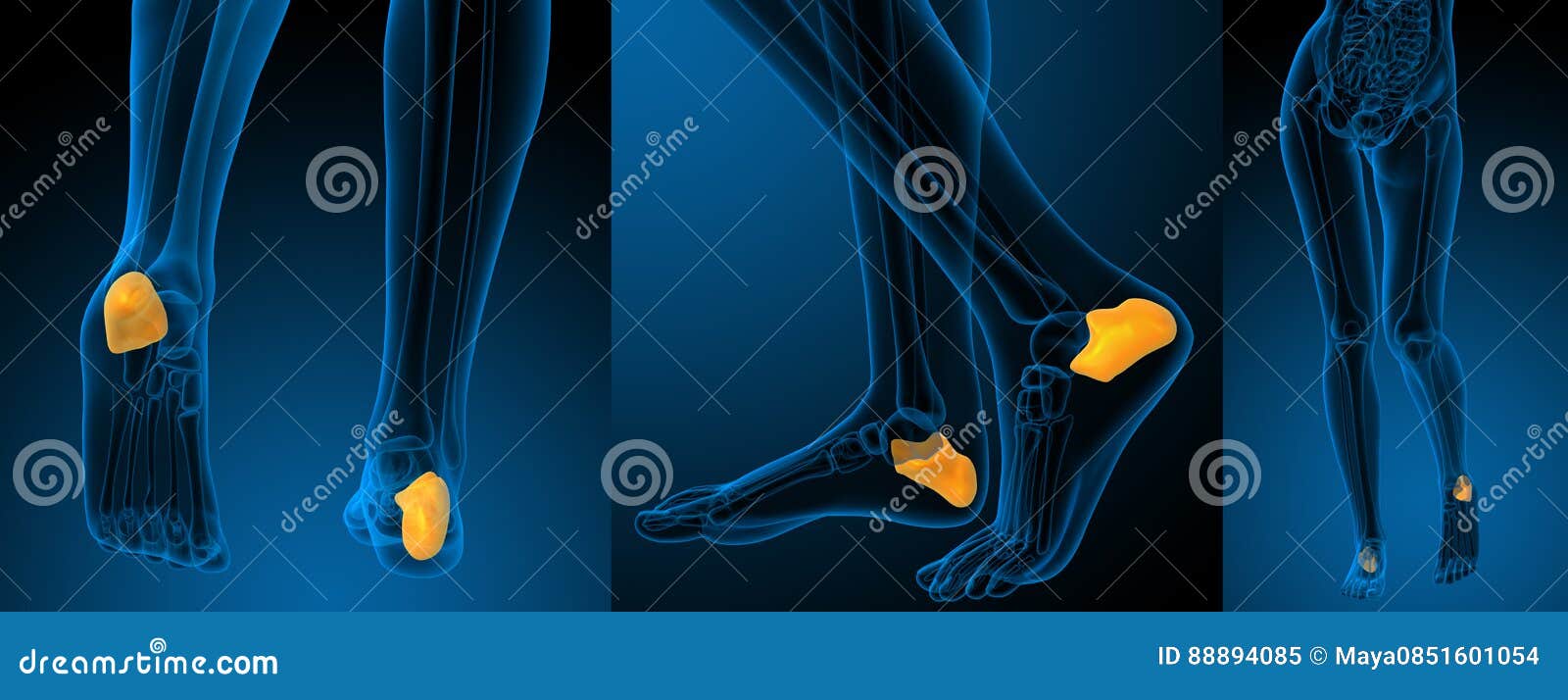 Human calcaneus bone stock illustration. Illustration of medical - 88894085