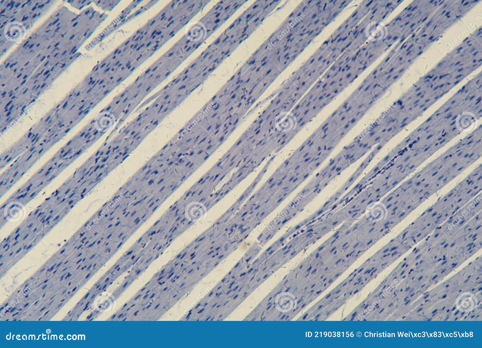 Human Cardiac Muscle Under the Microscope Stock Photo - Image of ...