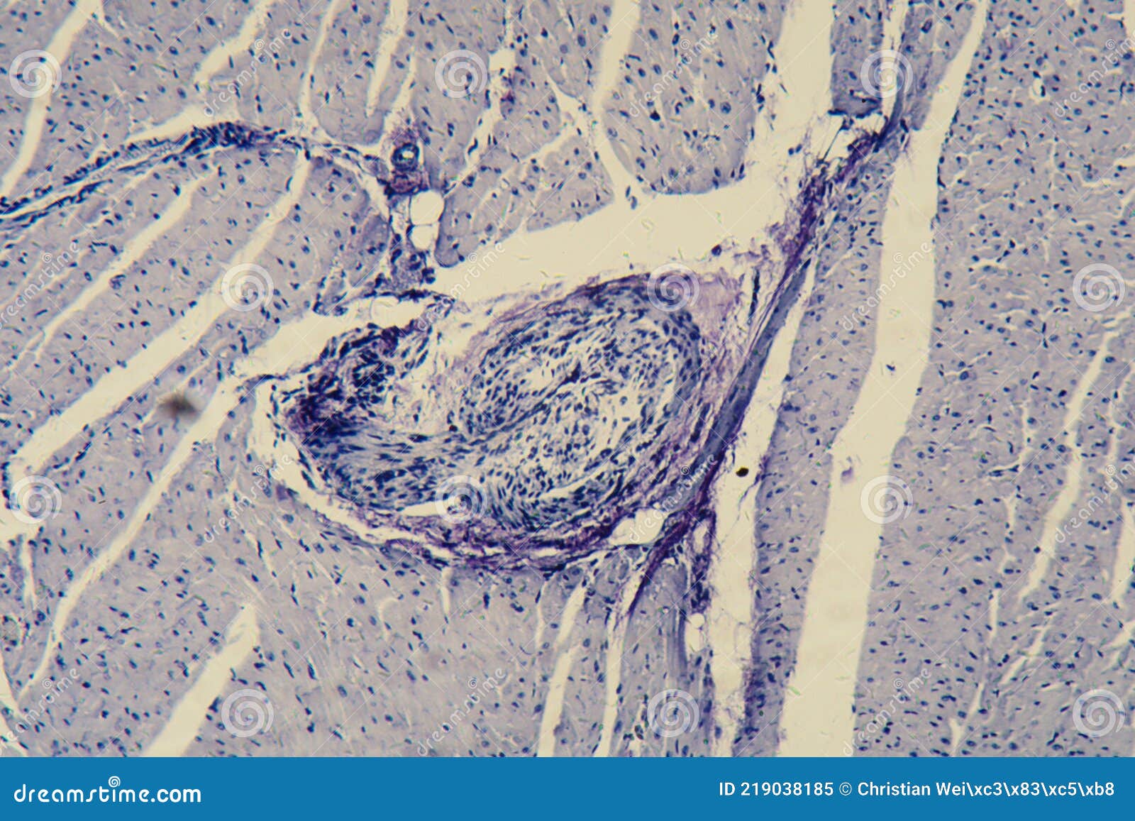 Cardiac Muscle Section Under The Microscope Royalty-Free Stock Image ...