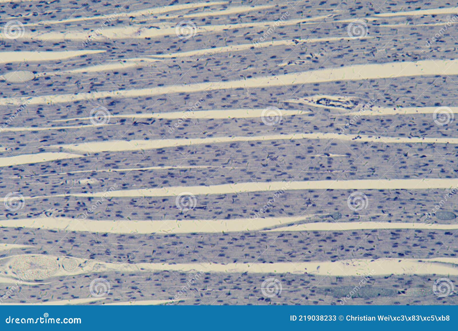 Human Cardiac Muscle Under the Microscope Stock Image - Image of line ...