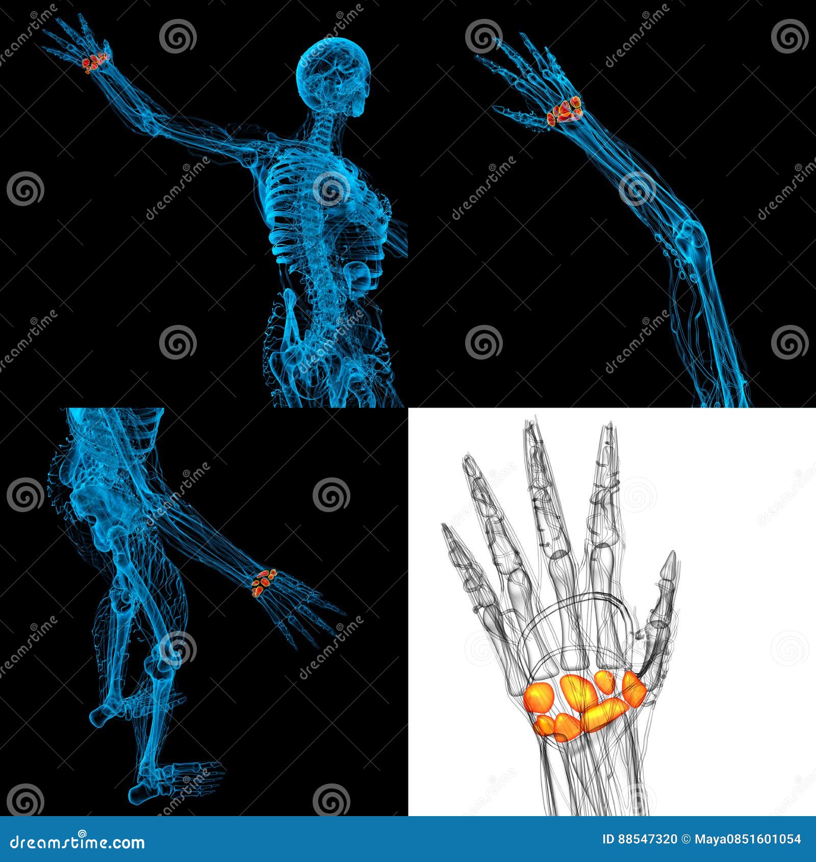 Human carpal bones stock illustration. Illustration of carpal - 88547320