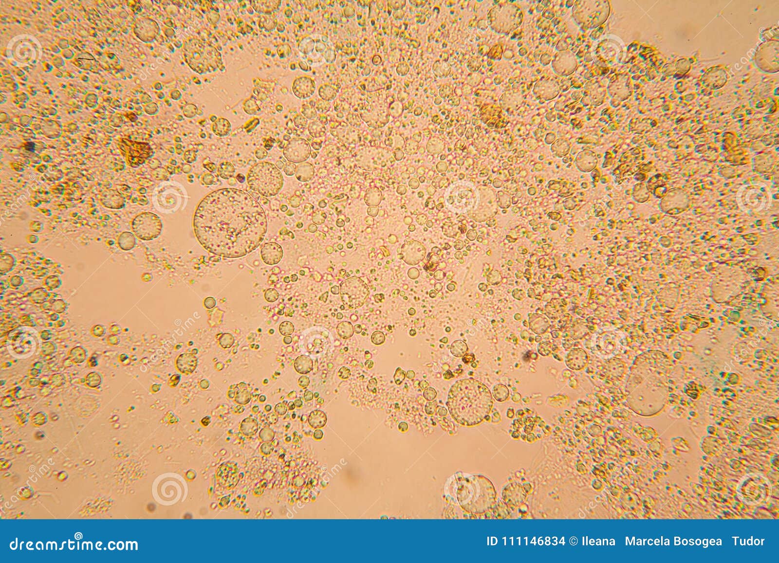 Human Cells and Water at the Microscope Stock Photo - Image of smear ...