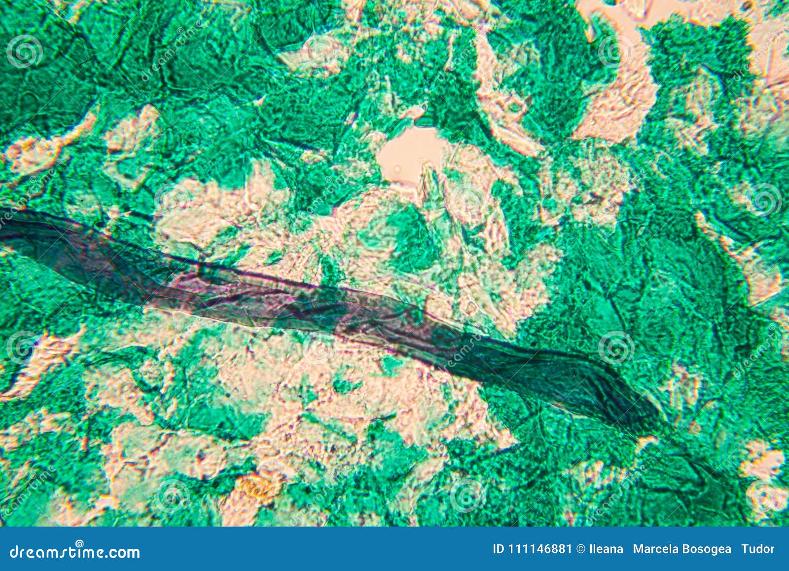 Human Cells and Water at the Microscope Stock Image - Image of medical ...