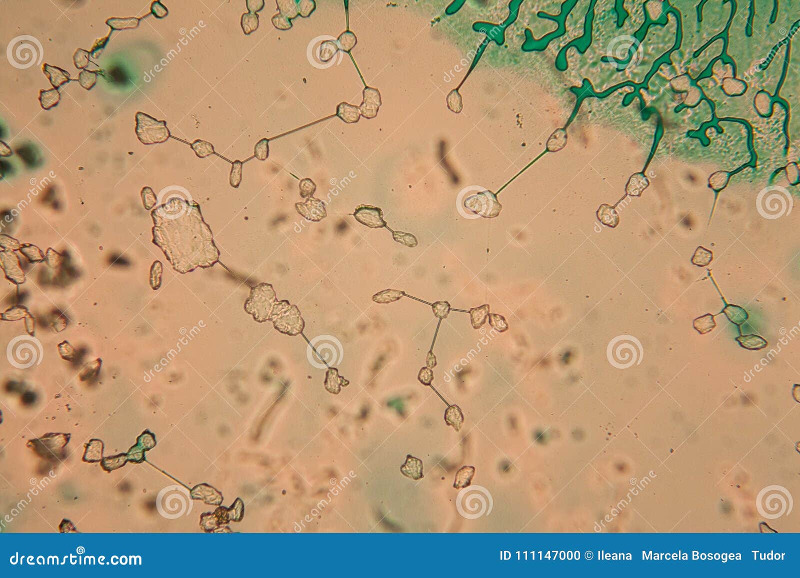 Human Cells and Water at the Microscope Stock Photo - Image of ...