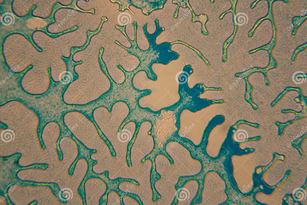 Human Cells and Water at the Microscope Stock Photo - Image of dried ...