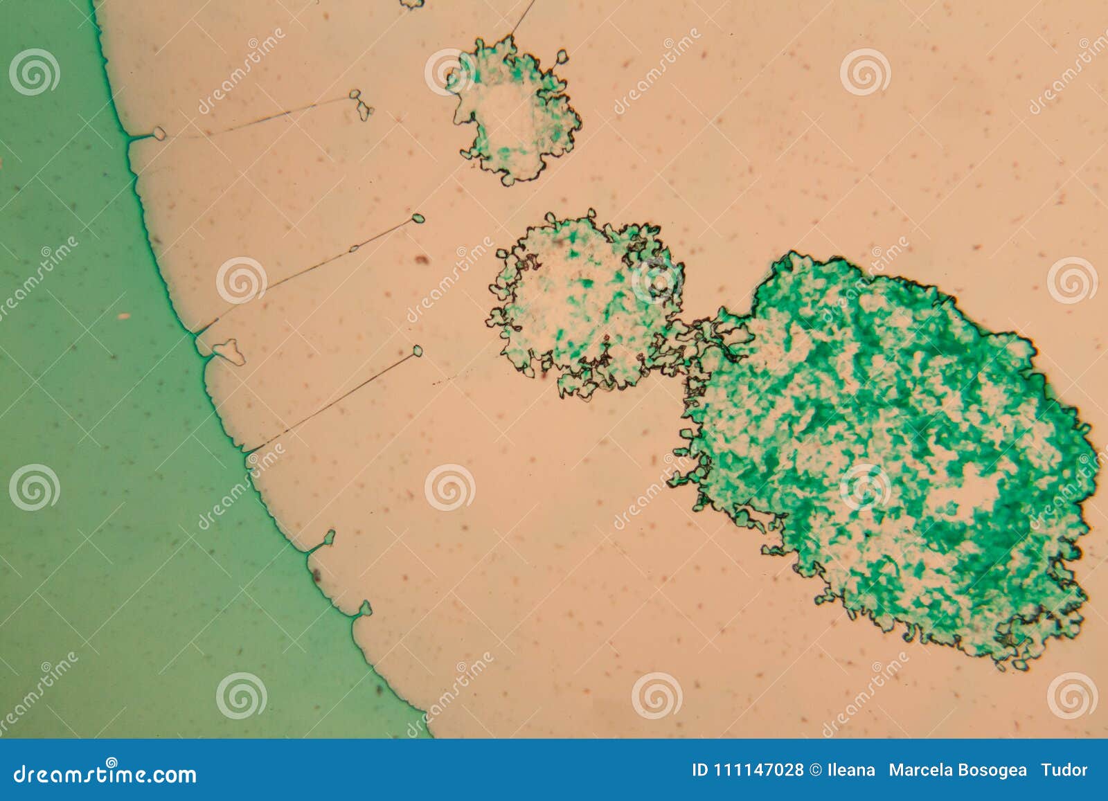 Human Cells and Water at the Microscope Stock Photo - Image of sample ...