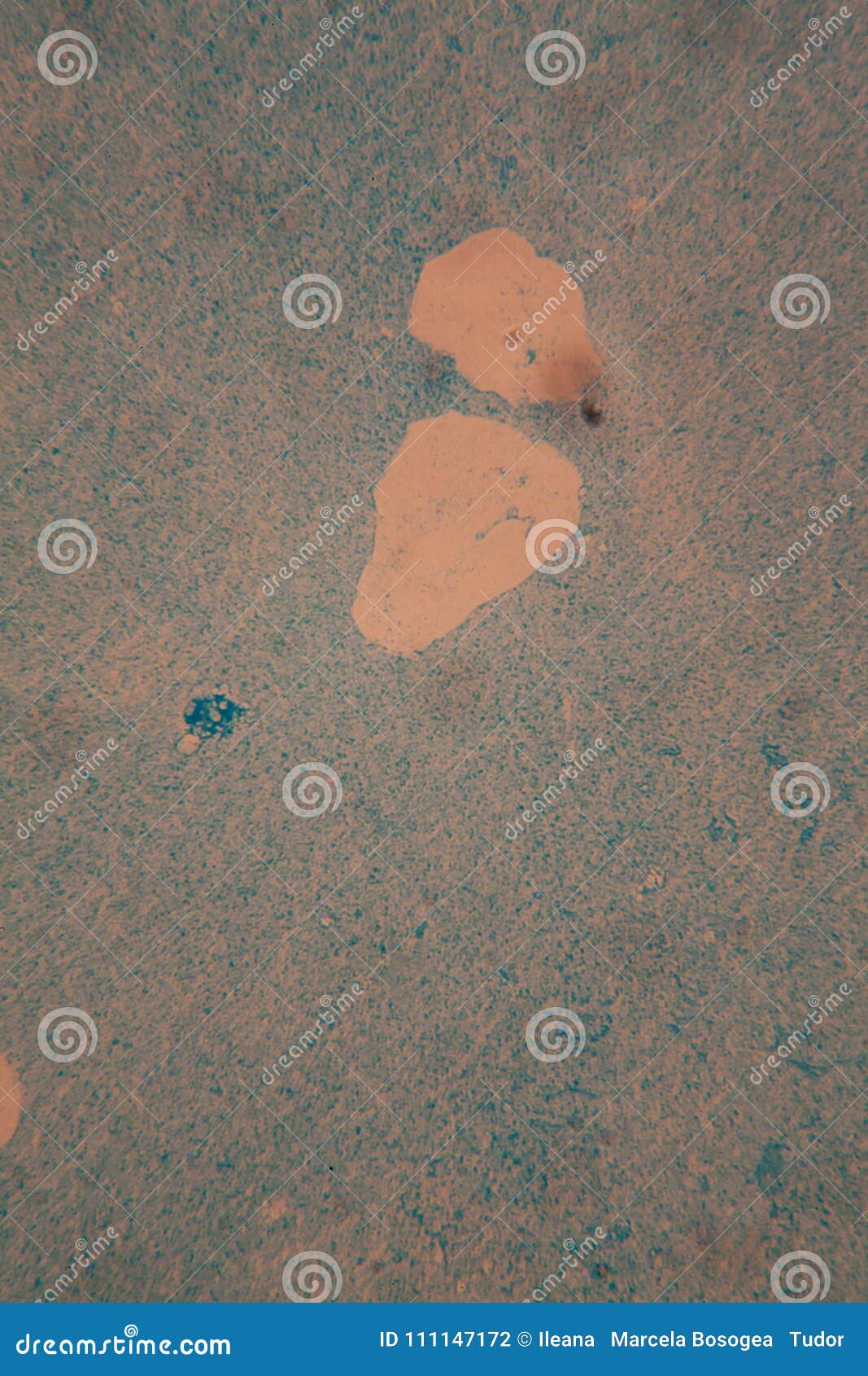 Human Cells and Water at the Microscope Stock Photo - Image of smear ...