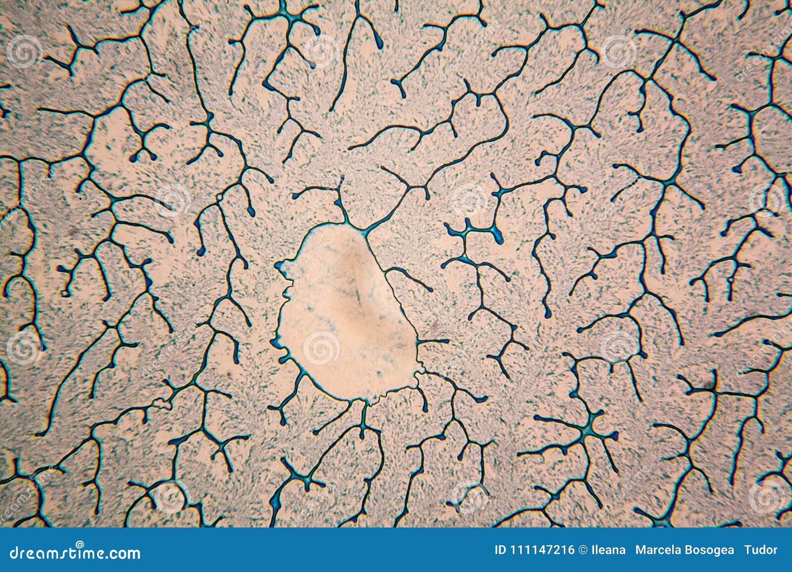 Human Cells and Water at the Microscope Stock Photo - Image of dried ...