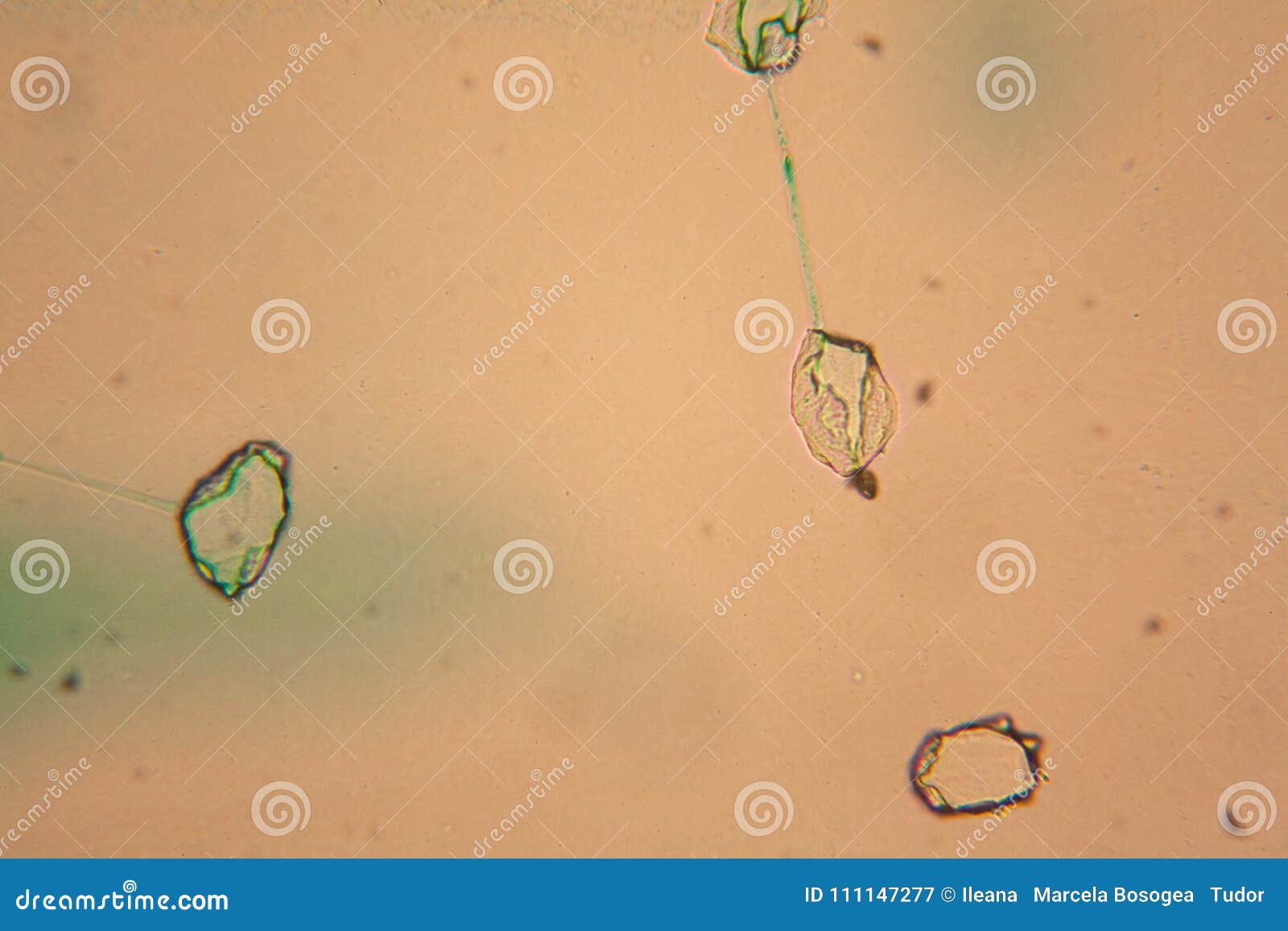 Human Cells and Dried Water at the Microscope Stock Image - Image of ...