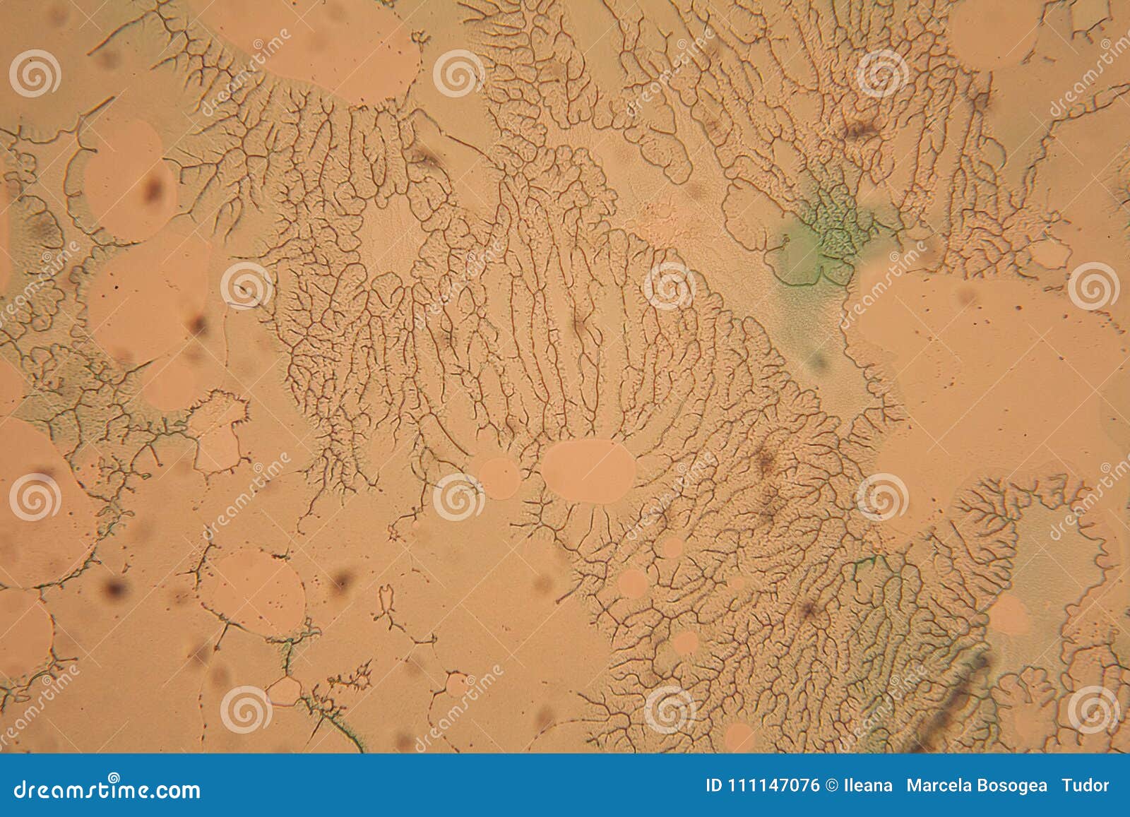 Human Cells and Water at the Microscope Stock Photo - Image of skin ...