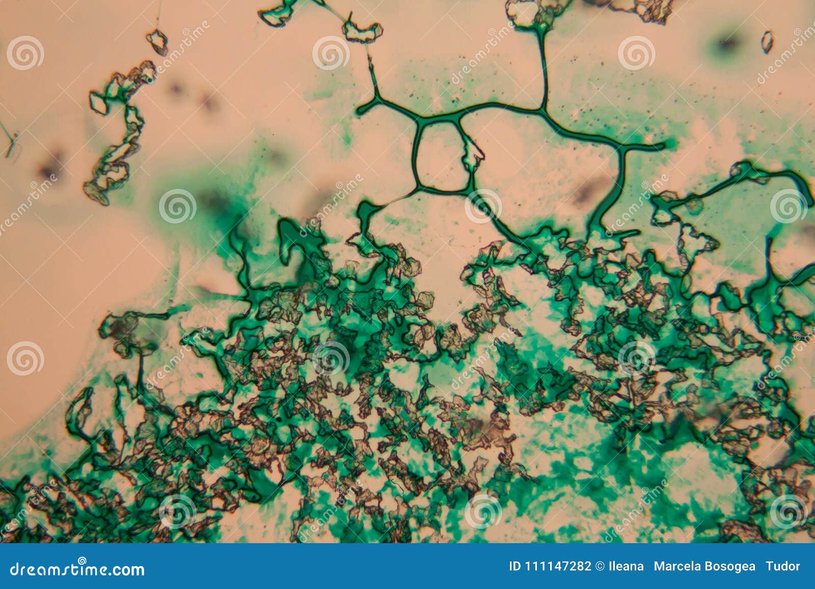 Human Cells And Dried Water At The Microscope Royalty-Free Stock Photo ...